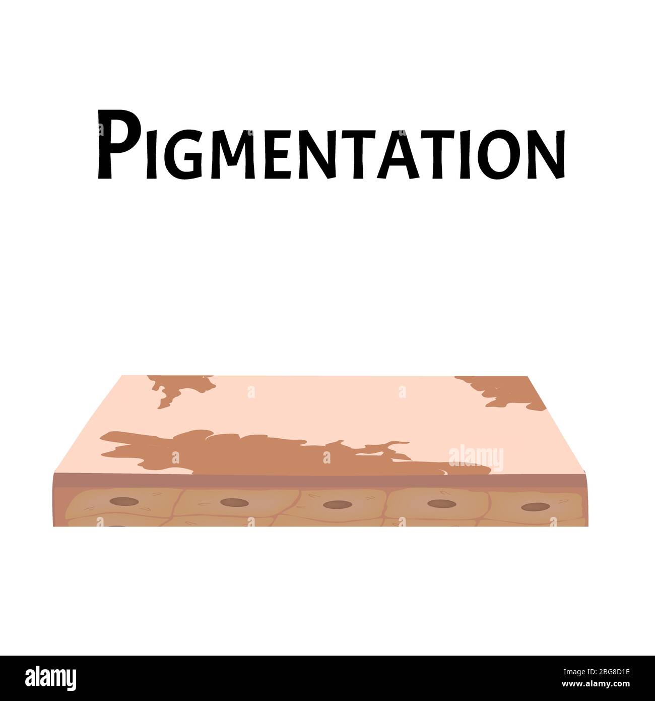 Pigmented epidermis Stock Vector Images - Alamy