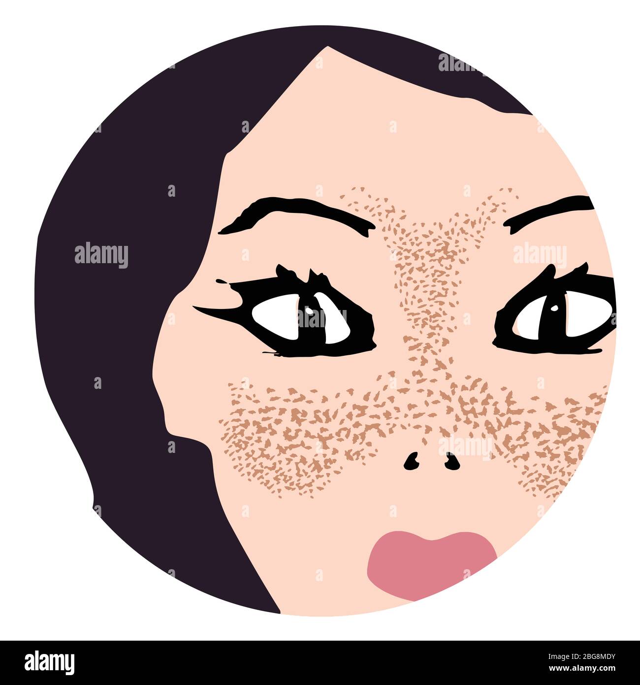 Freckles on the face. Pigmentation on the skin. A pigmented spot on the ...