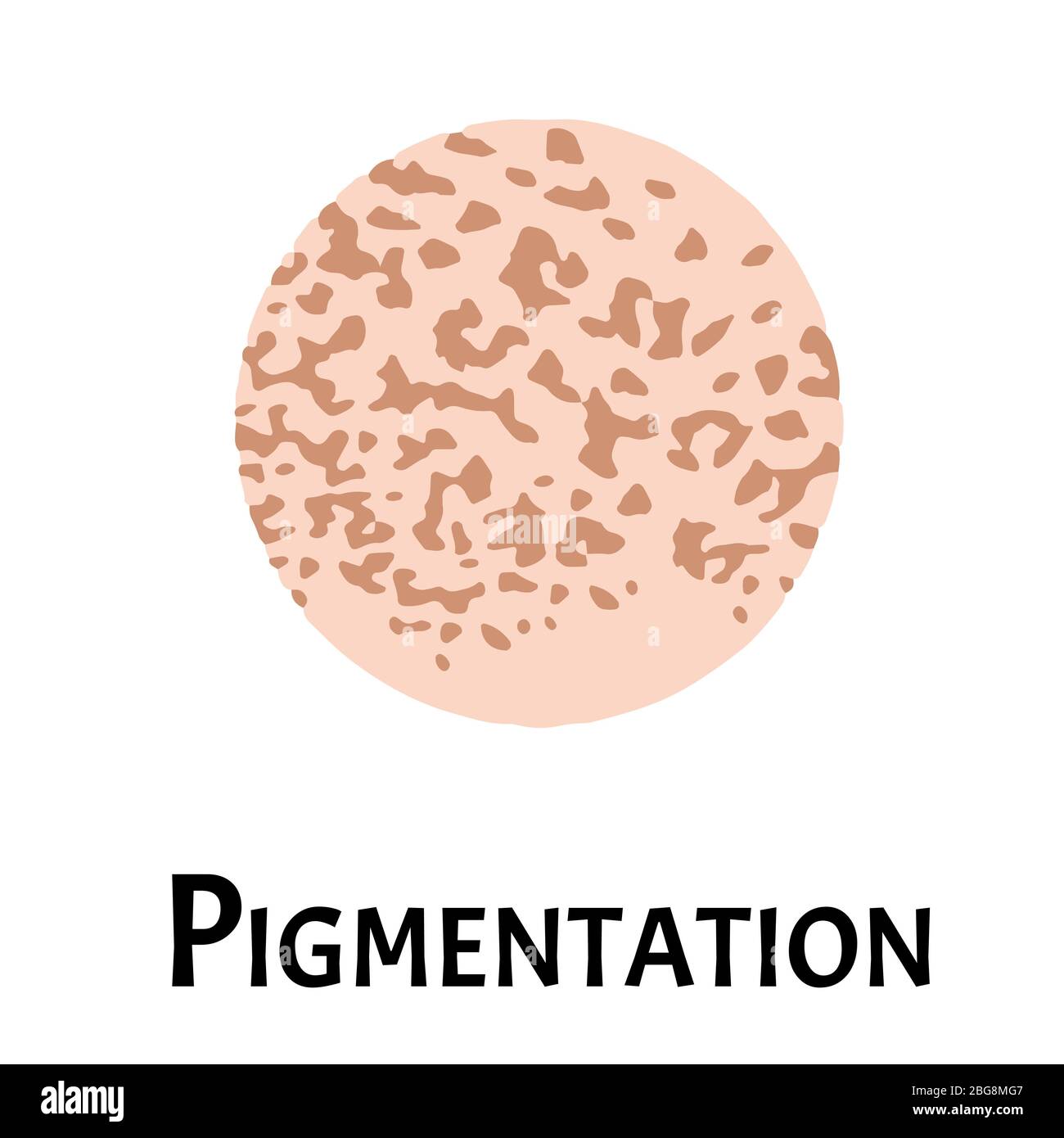 Pigmentation on the skin. A pigmented spot on the skin of the face ...