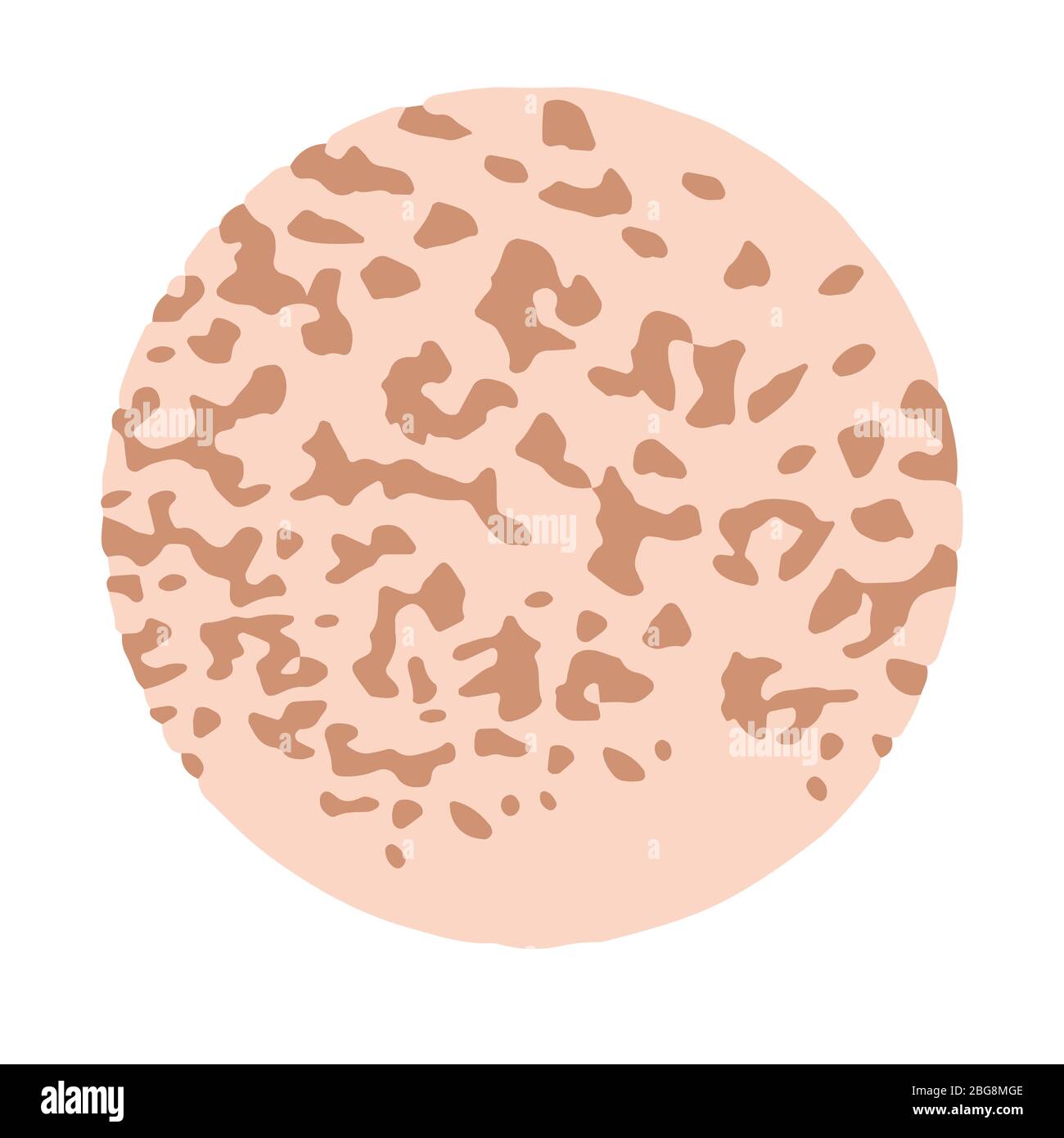 Pigmentation on the skin. A pigmented spot on the skin of the face ...