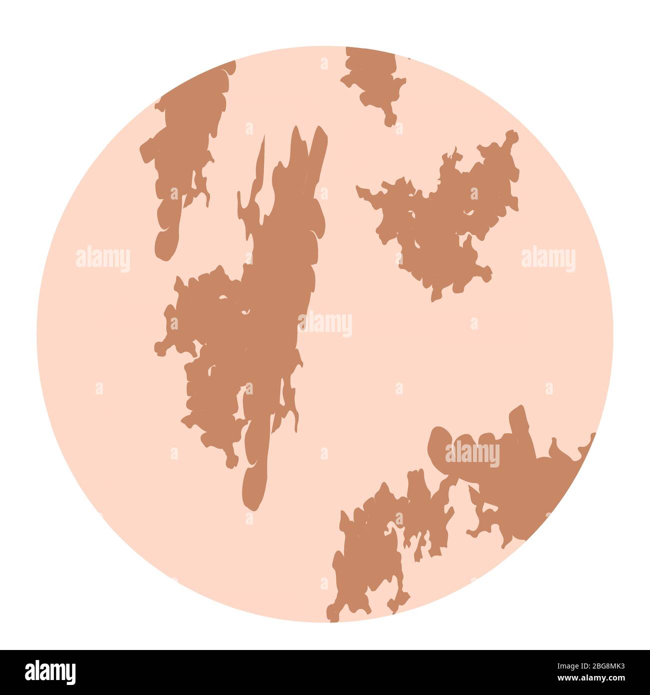 Pigmentation on the skin background. A pigmented spot on the skin of ...
