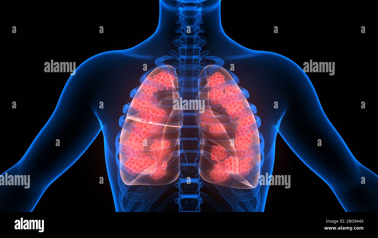 Human Respiratory System Lungs with Alveoli Anatomy Stock Photo - Alamy