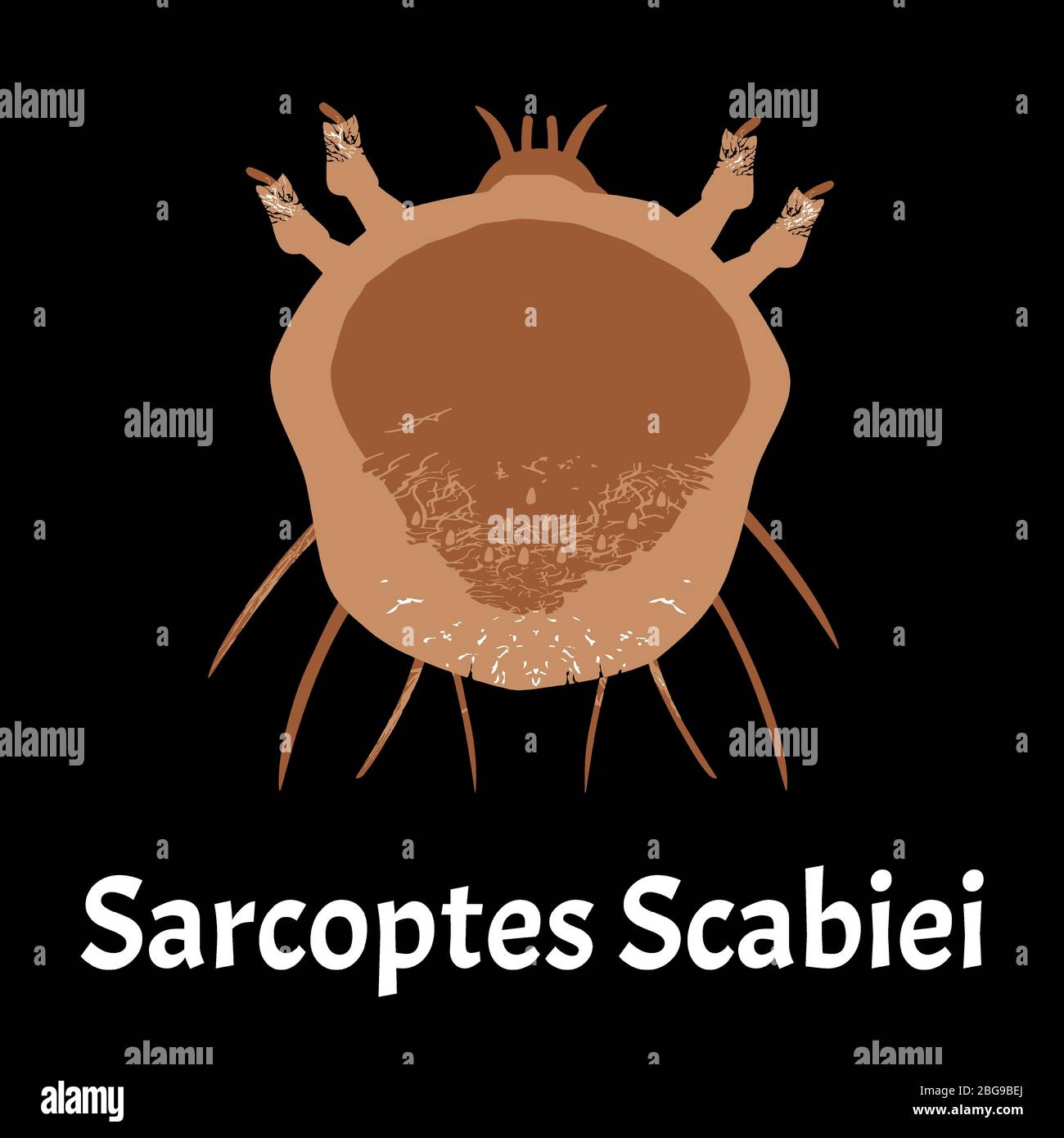 Albums 92 Pictures What Are Scabies Images Updated