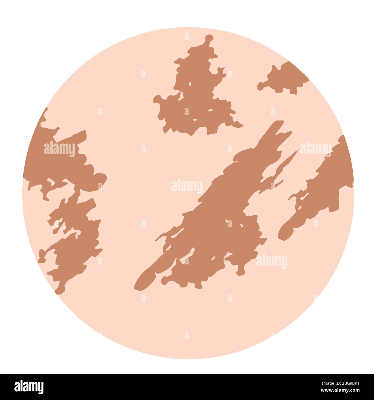 Pigmentation on the skin background. A pigmented spot on the skin of ...