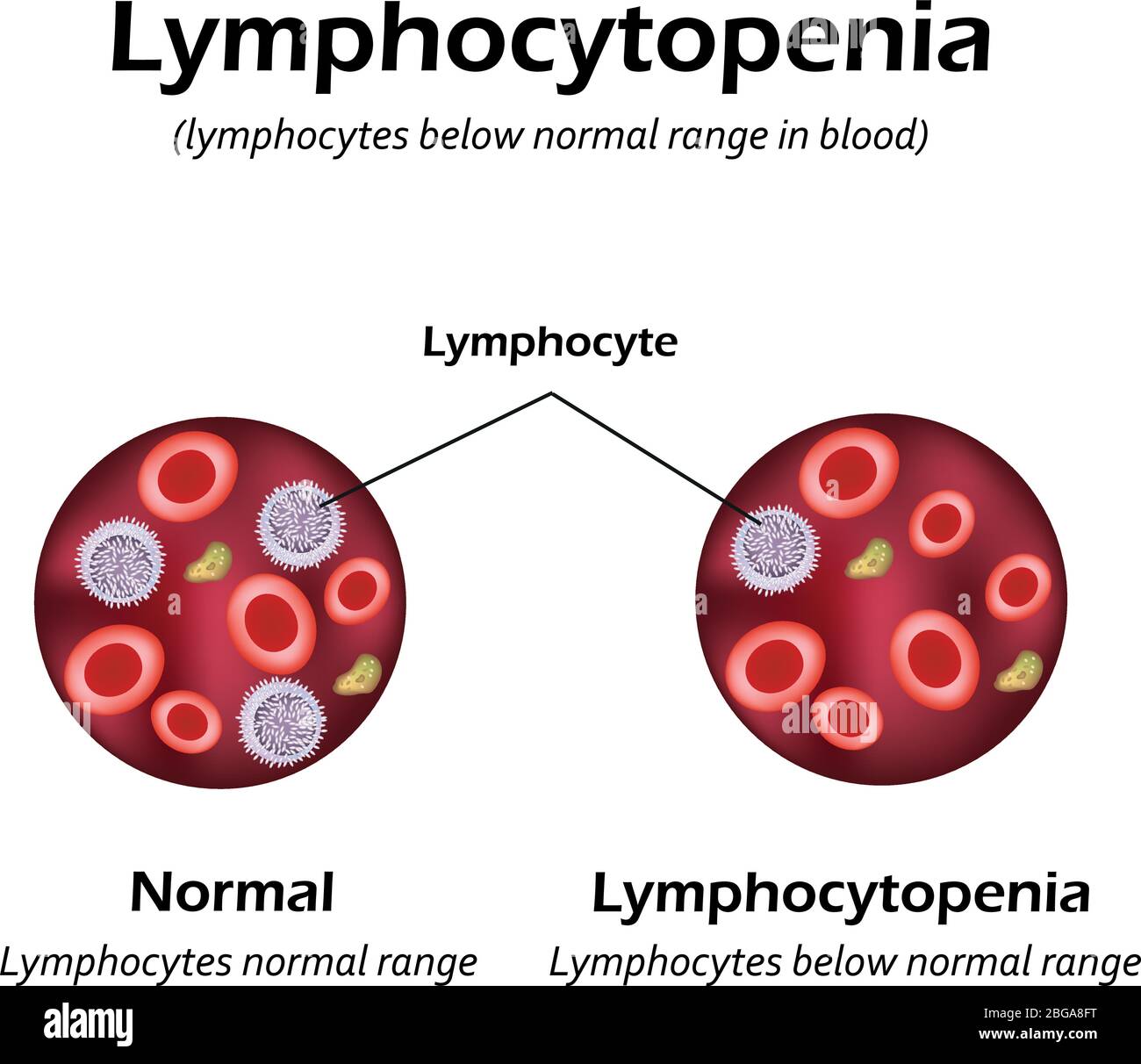 Lymphocytes Images