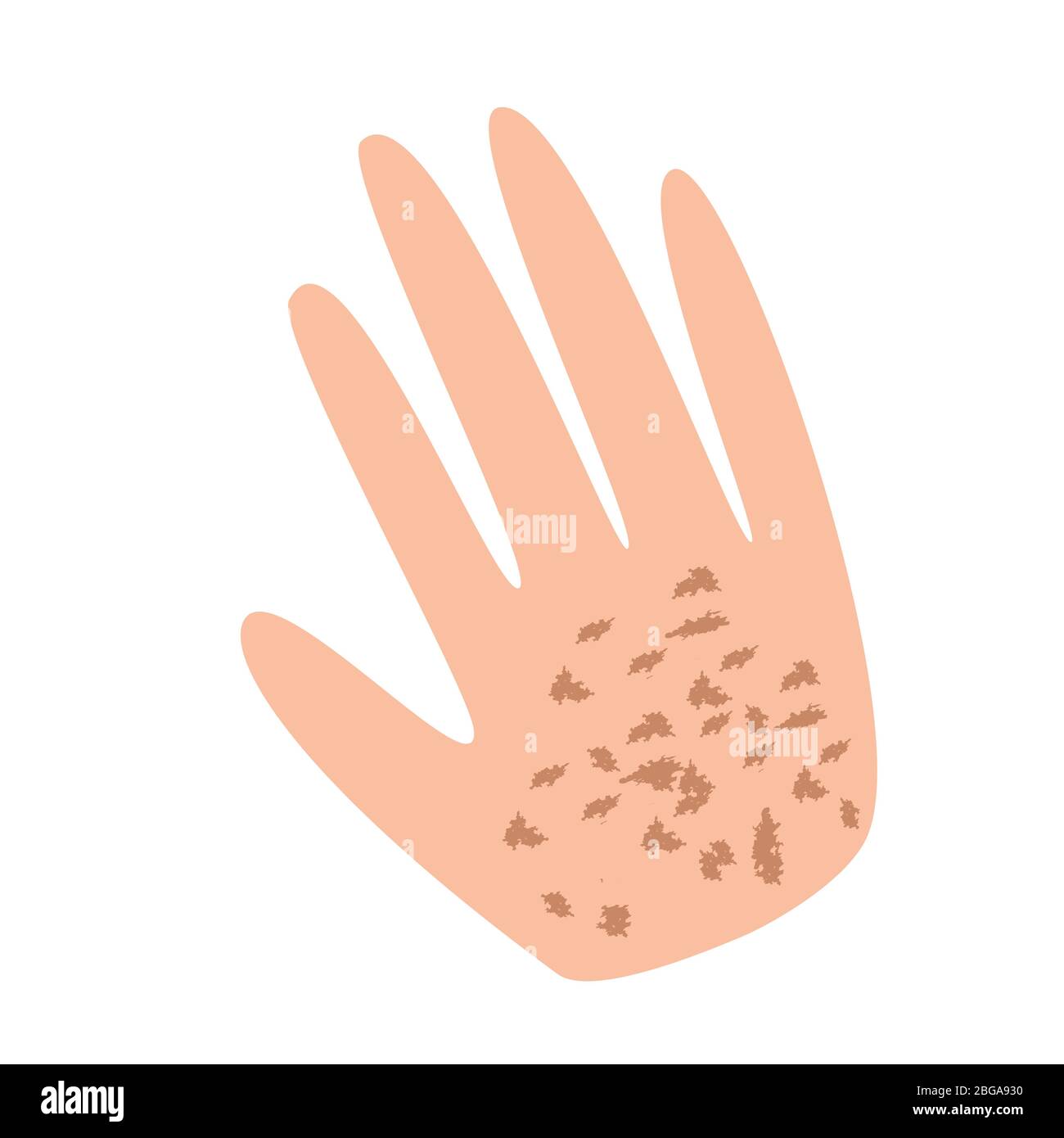 Sun spots hand hi-res stock photography and images - Alamy