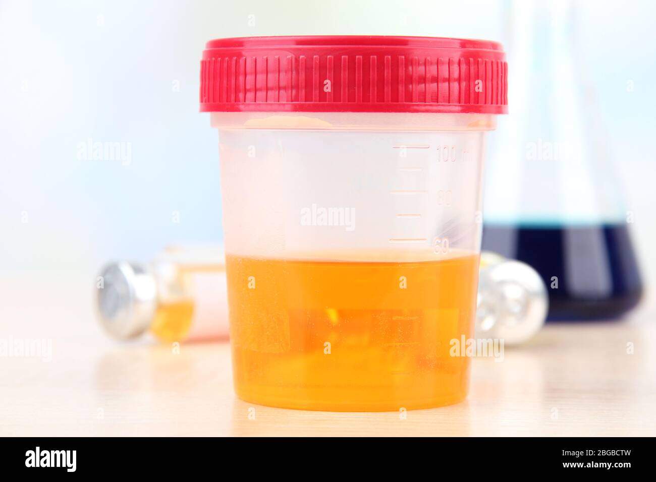 Medical urine test, close-up Stock Photo - Alamy