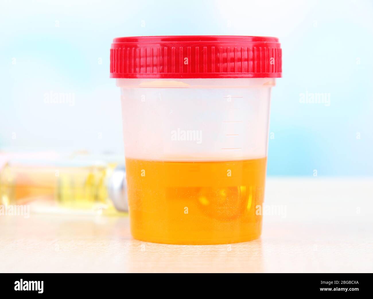 Medical urine test, close-up Stock Photo - Alamy