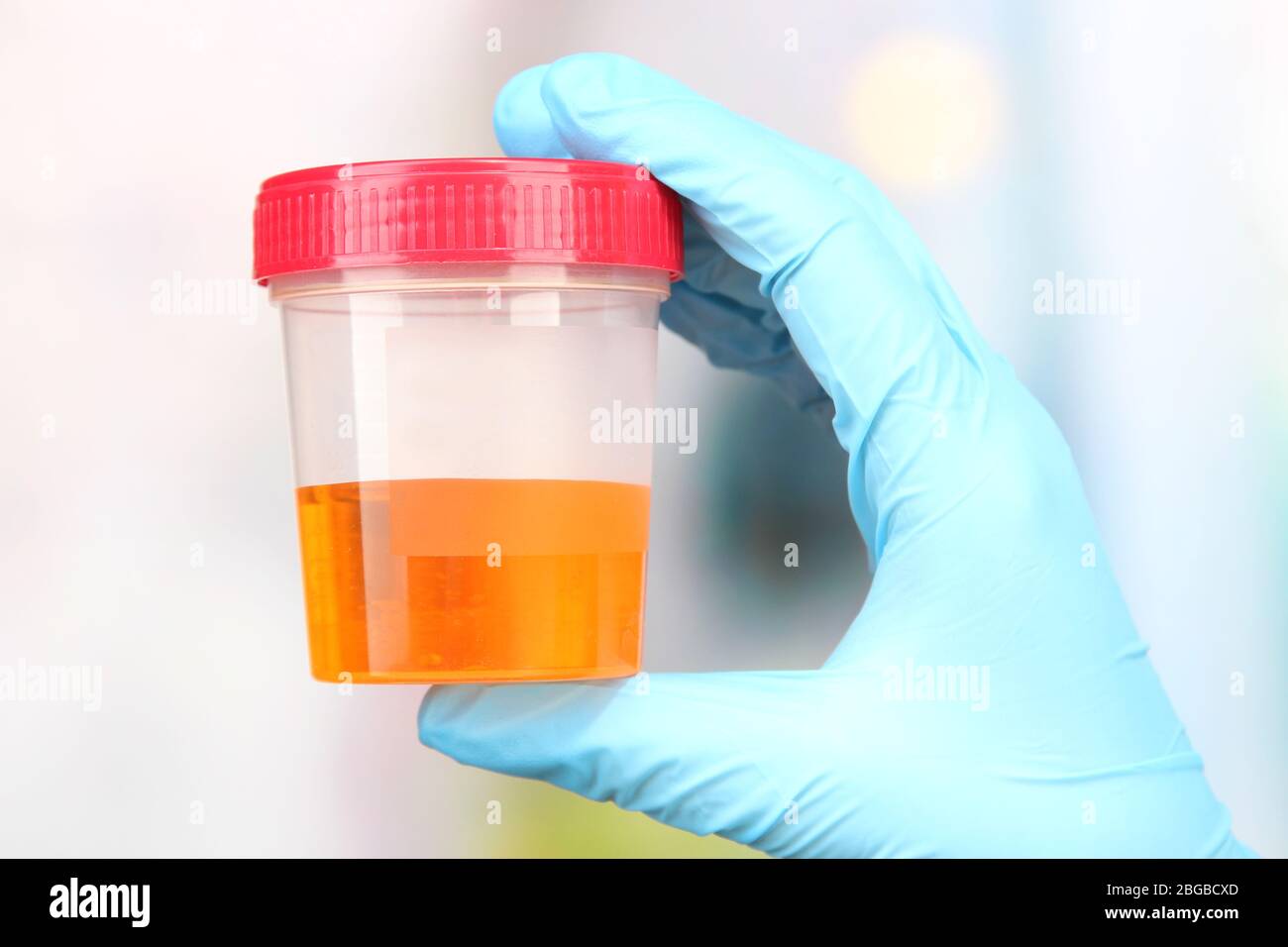 Medical urine test, close-up Stock Photo - Alamy