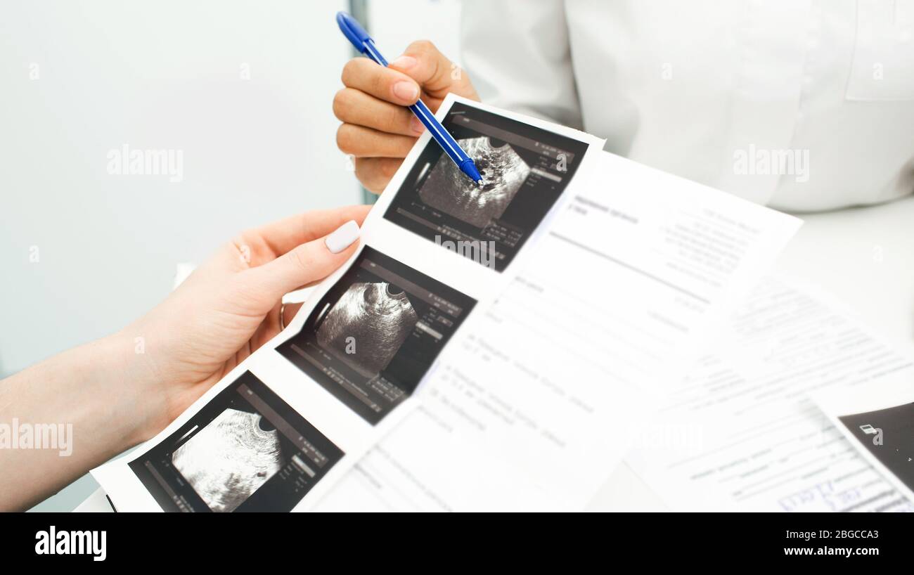 gynecology, folliculometry results. Pregnancy planning, dominant ...