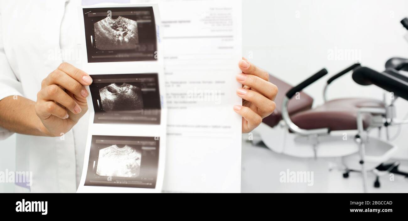 Examination of the pelvic organs. Ovaries, uterus, ultrasound analysis ...