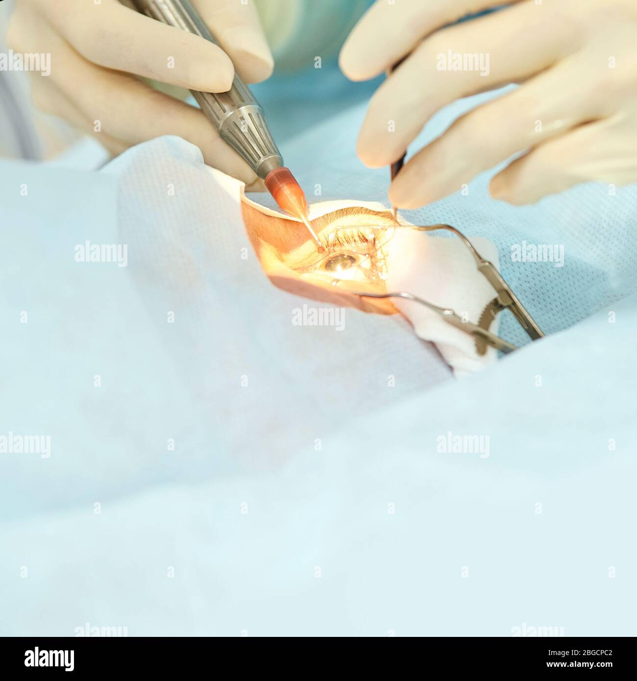 Ophthalmology laser microscope operation. Doctor in clinic. Patient eye ...