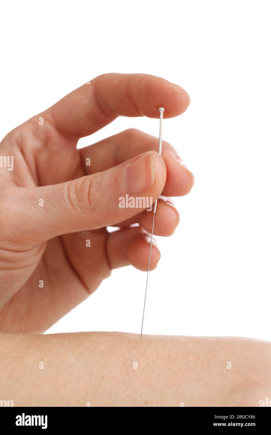 Acupuncture Nerve Pain Relief