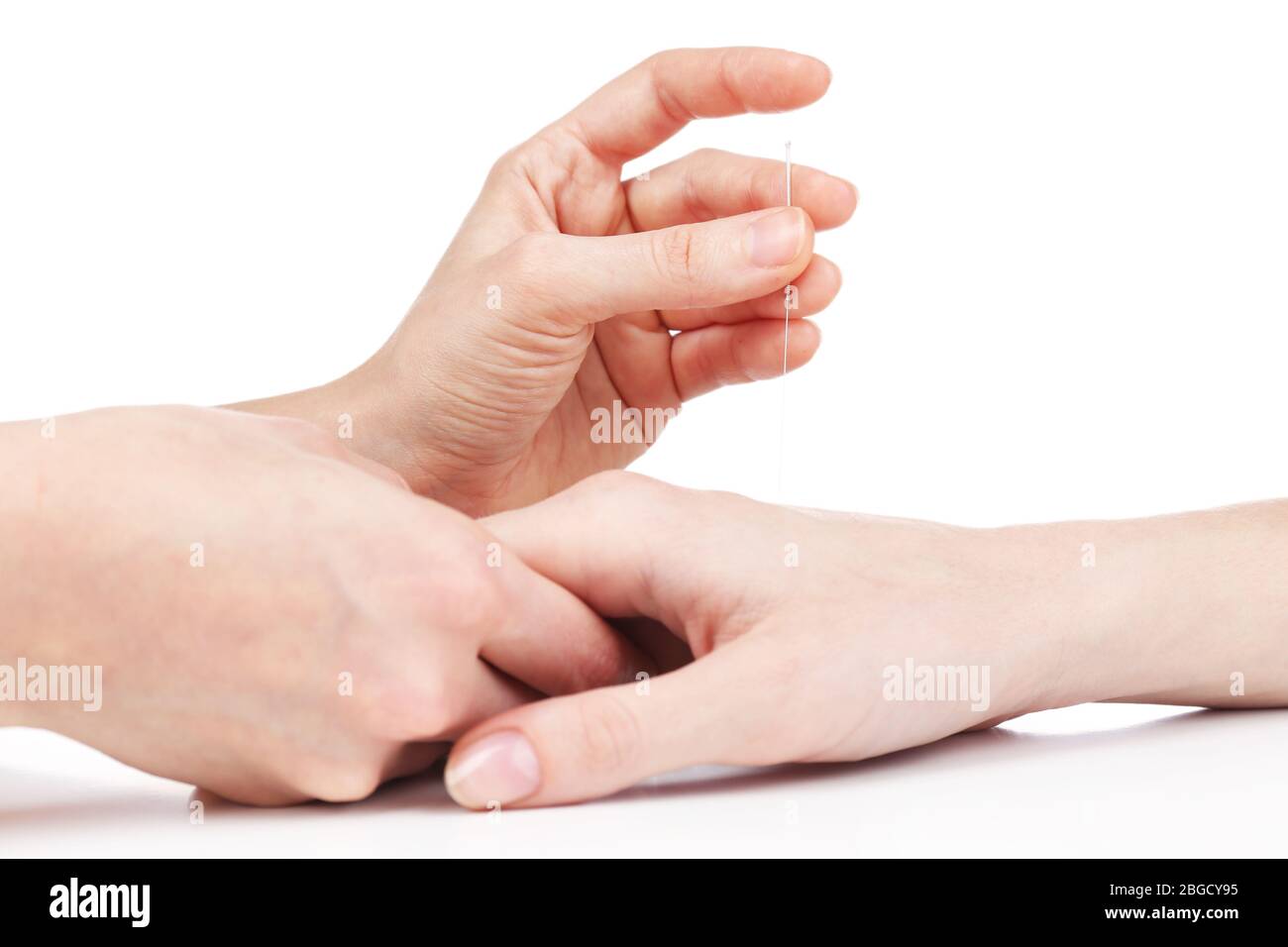 Acupuncture on hand, close up. Isolated on white Stock Photo - Alamy