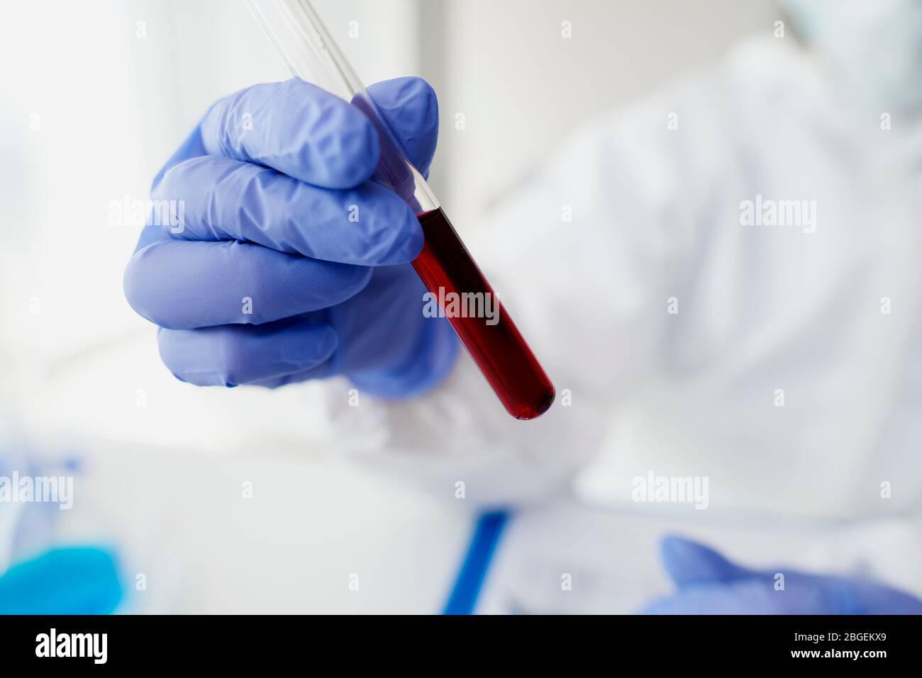 Test tube full of blood Stock Photo - Alamy