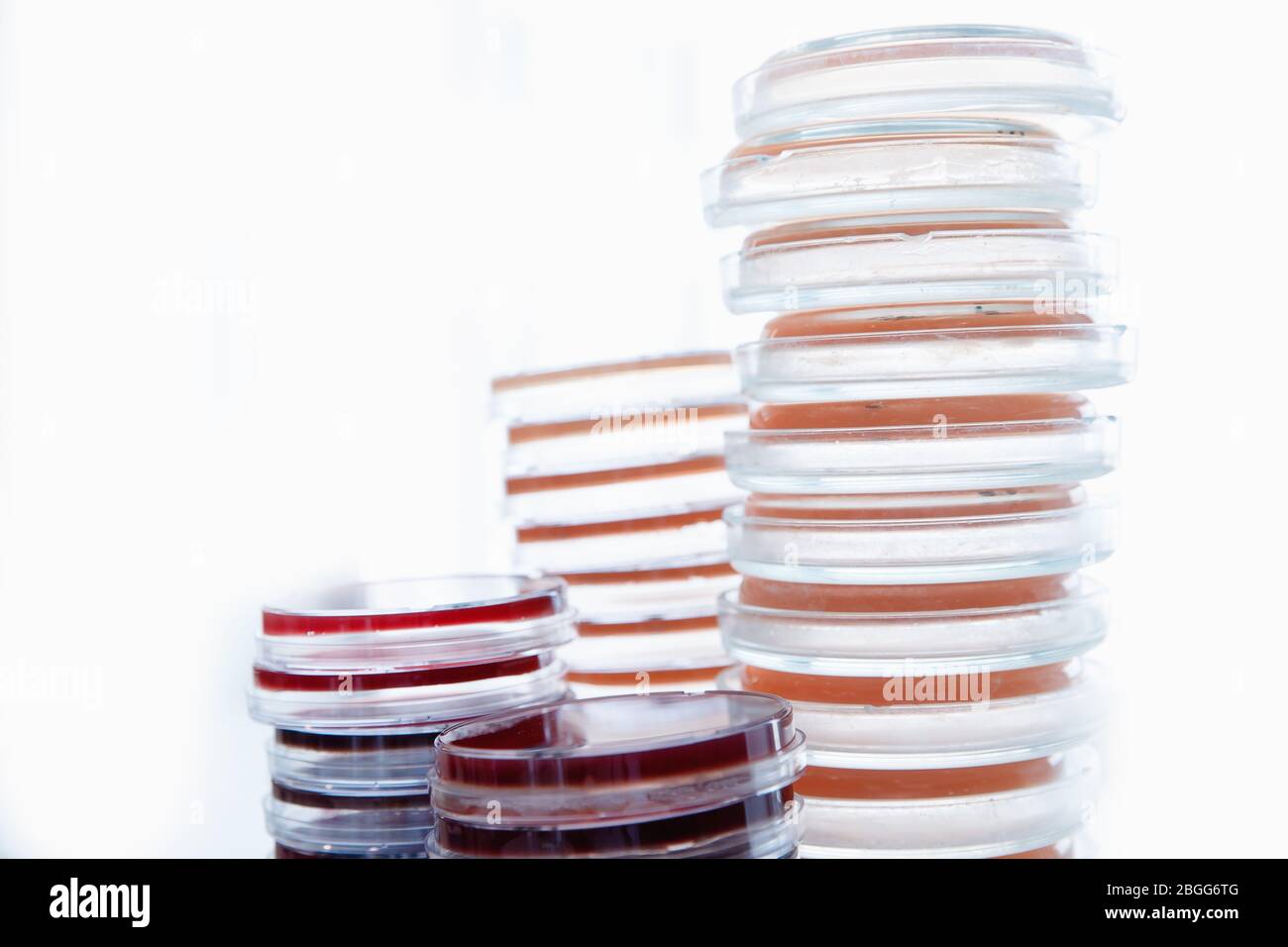Microbiology laboratory yeast cultivation on agar medium plate, white ...