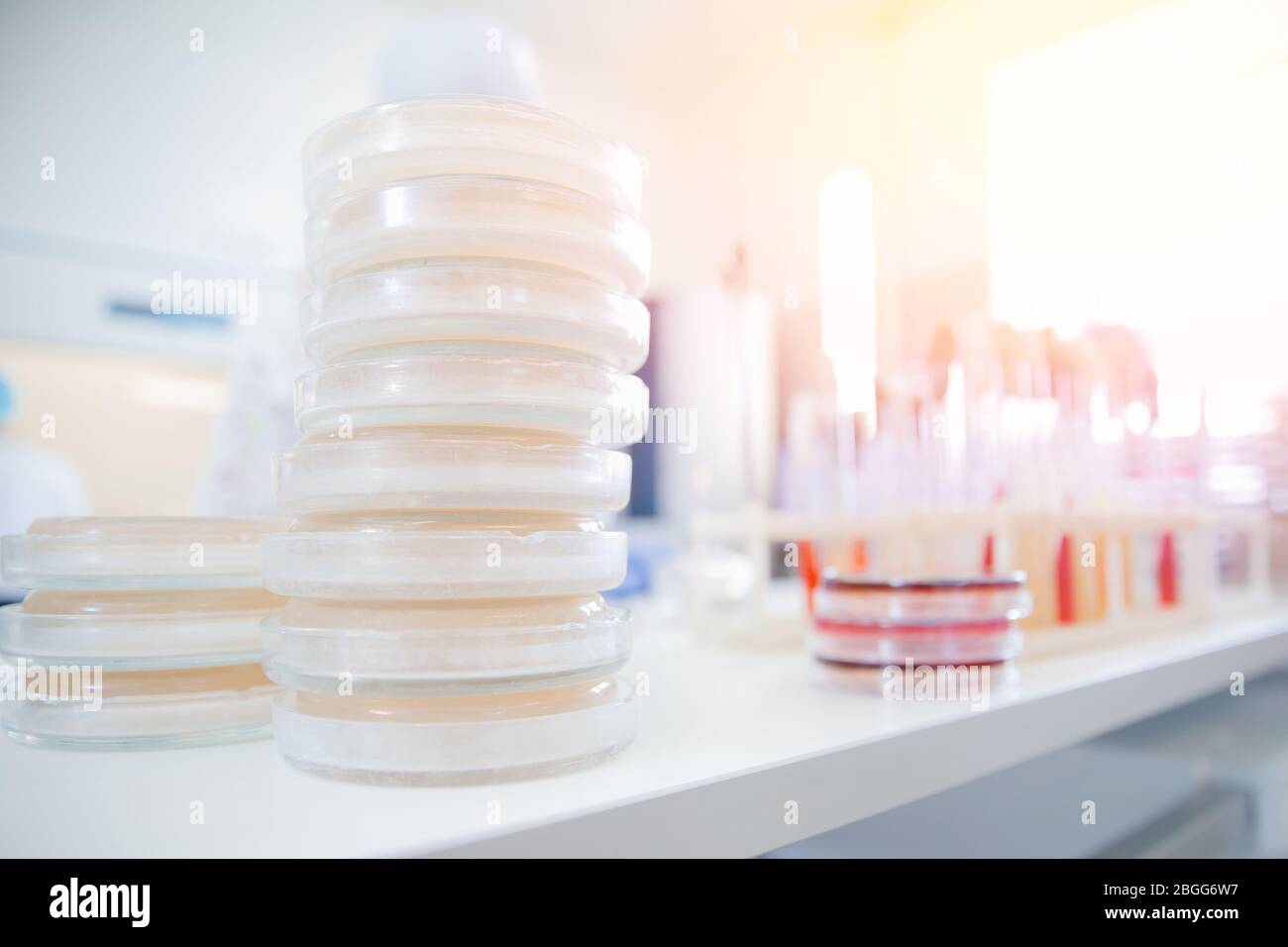 Microbiology laboratory yeast cultivation on agar medium plate, white ...