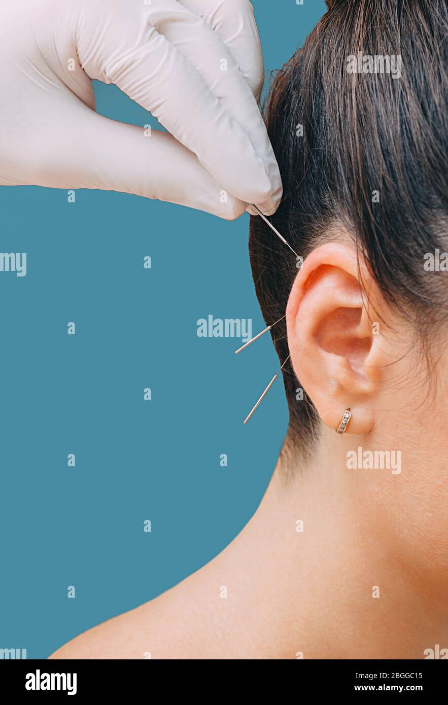 Hand of a reflexologist with an acupuncture needle near a woman's ear ...