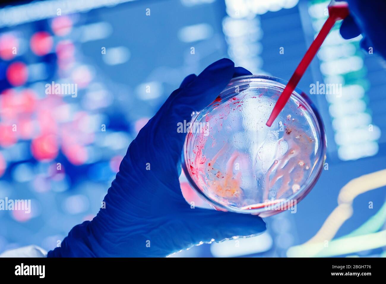 Analysis number infected people in world from 2019-ncov coronavirus ...