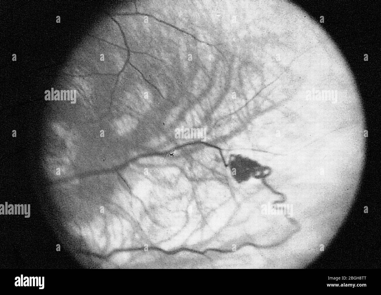 Hippel hi-res stock photography and images - Alamy