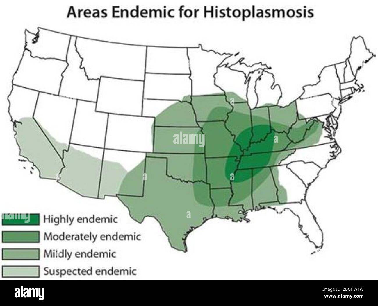 Histoplasmosis hi-res stock photography and images - Alamy