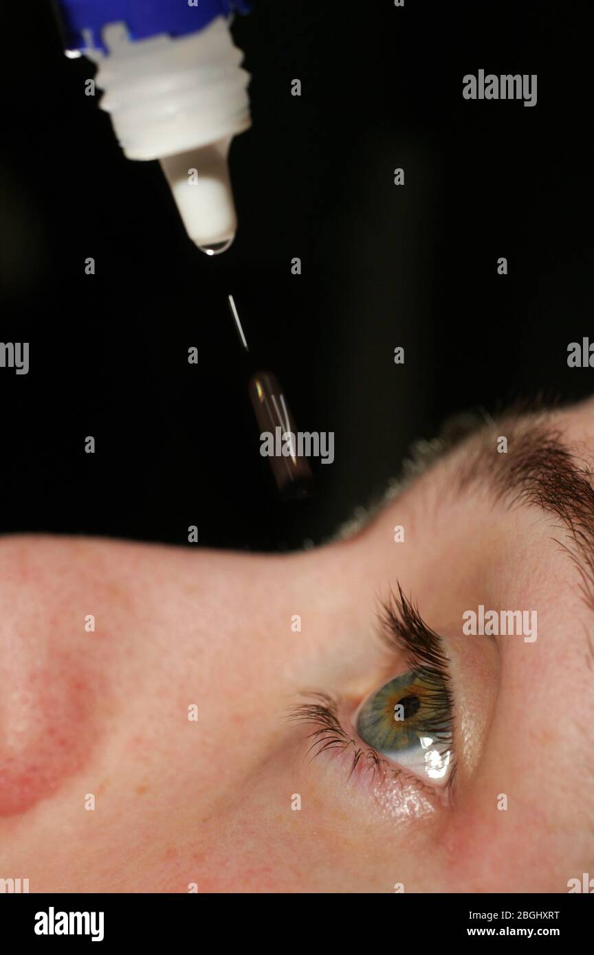 A young man applying eye drops. The eye drops act as a medicated ...