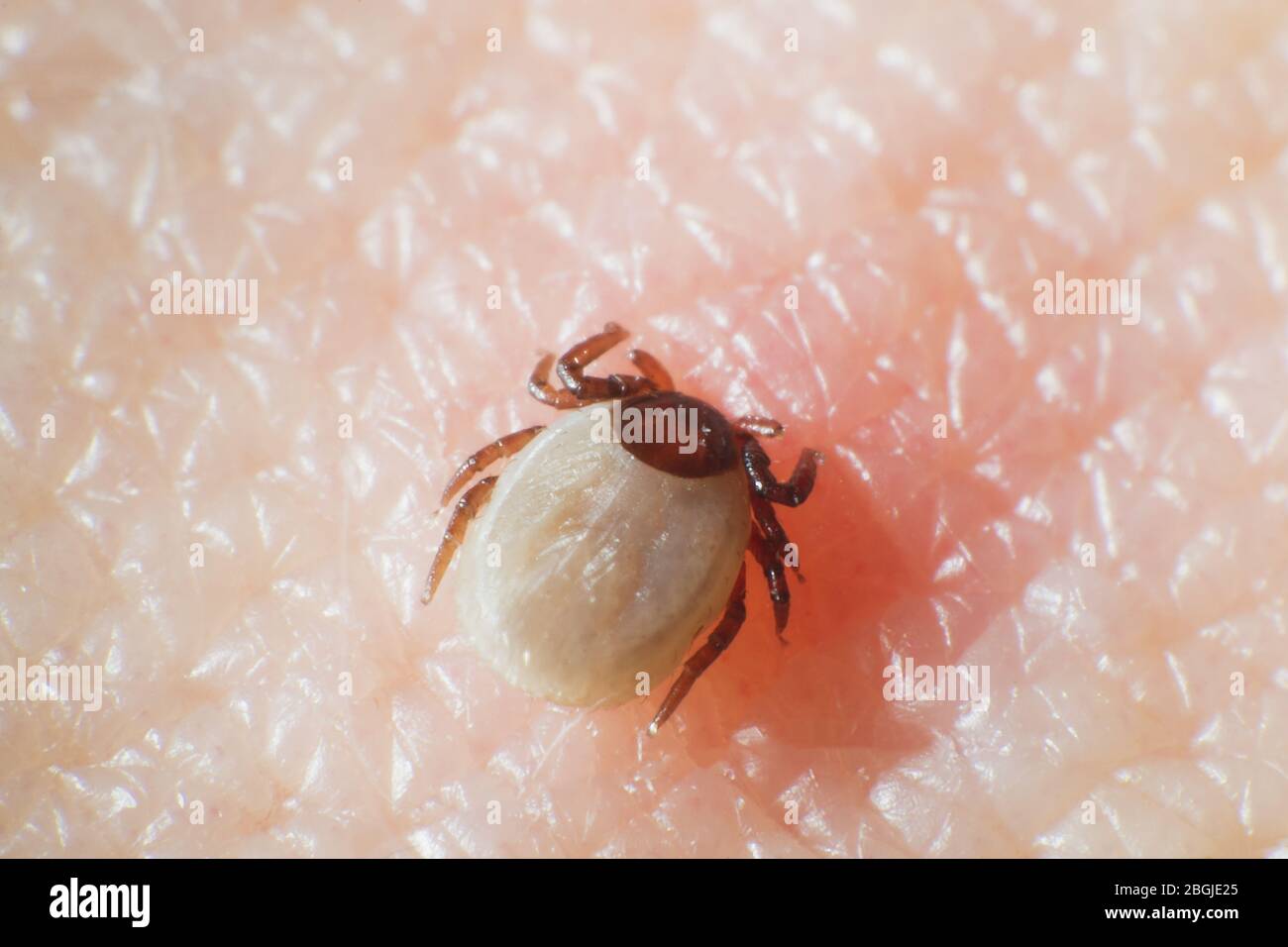 Deer Mites On Humans
