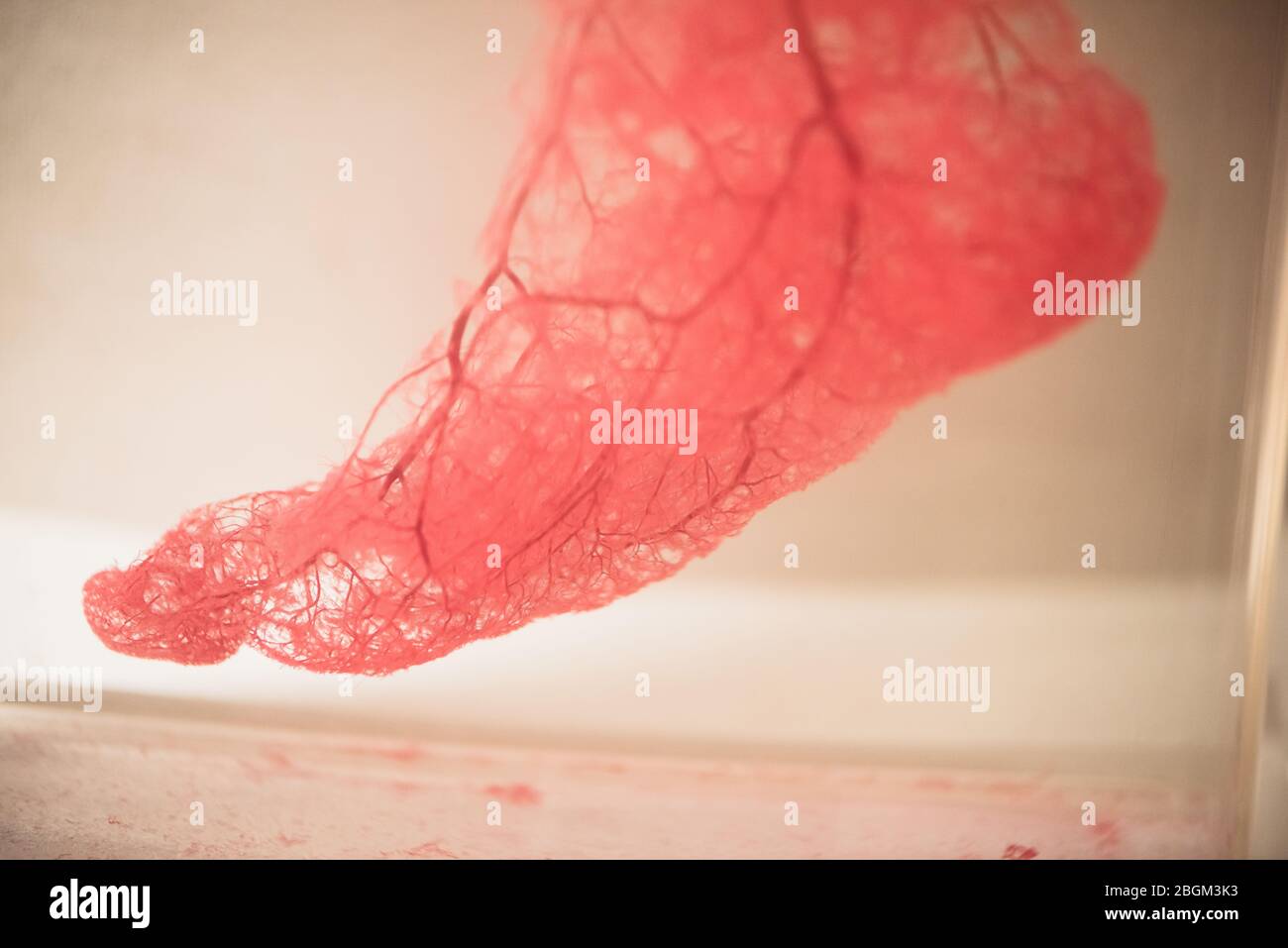 Blood Vessels of human foot Stock Photo - Alamy