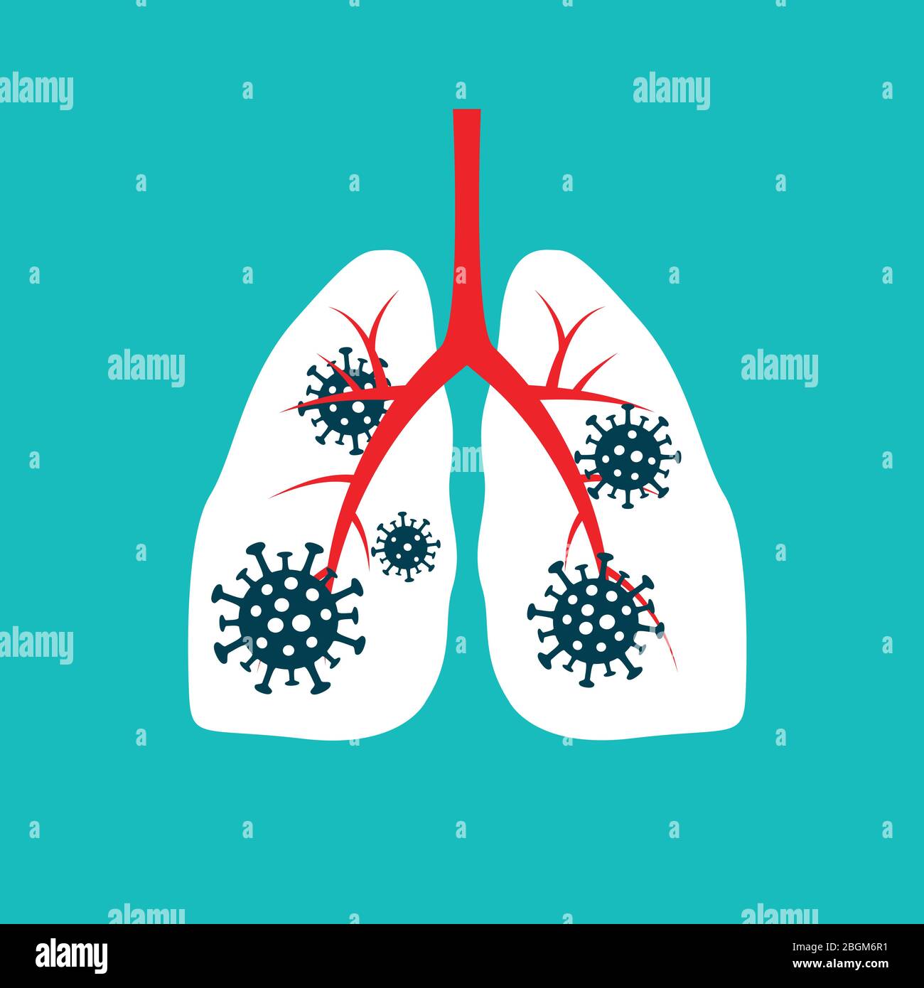 Virus cells eating lung. Virus cells biting lung. Damaged lung. Virus ...