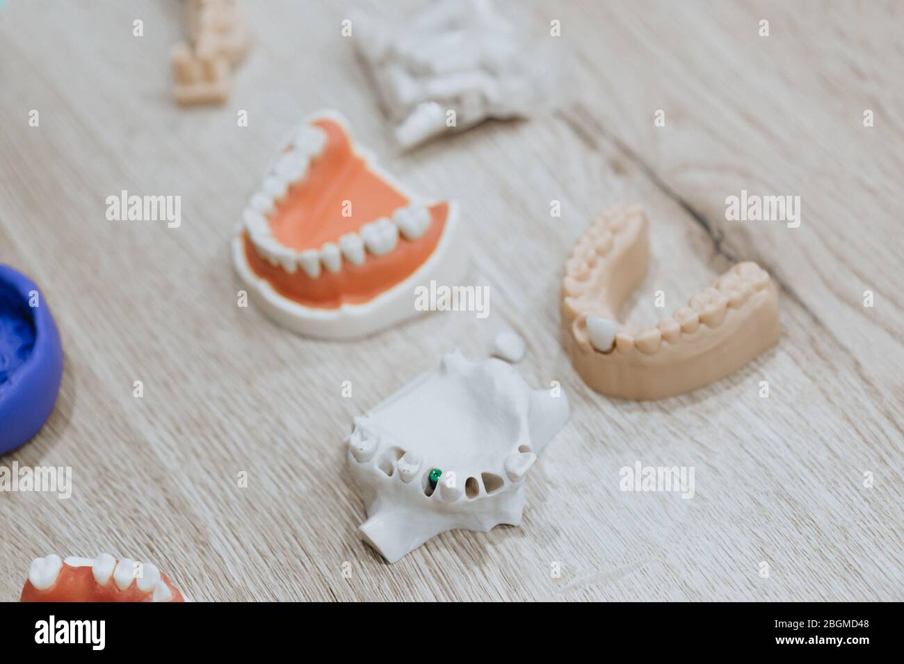 Plastic models of the jaw for prosthetics in dentistry and ...