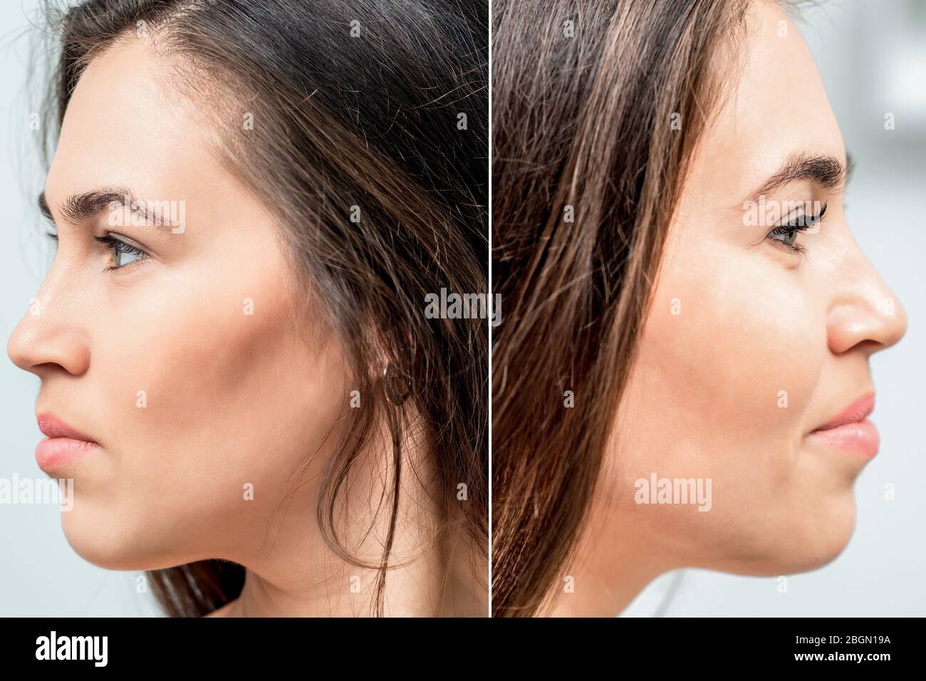 Side view portrait of woman with comparison her eyes before and after ...
