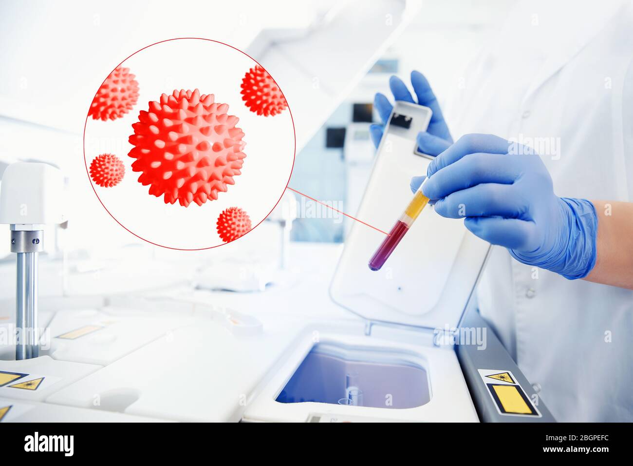Microbiology positive blood test result for rapidly spreading 2019-ncov ...