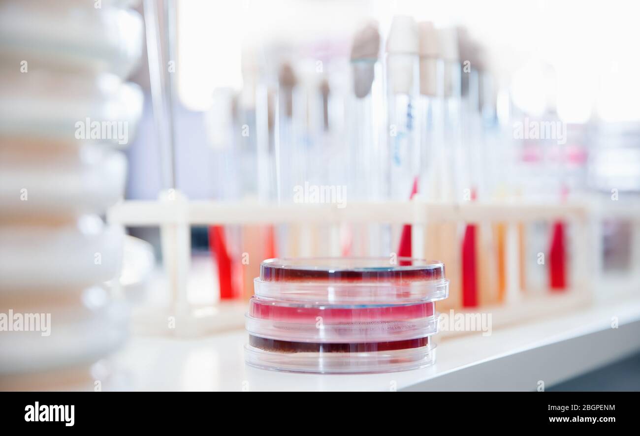 Microbiology laboratory yeast cultivation on agar medium plate, white ...