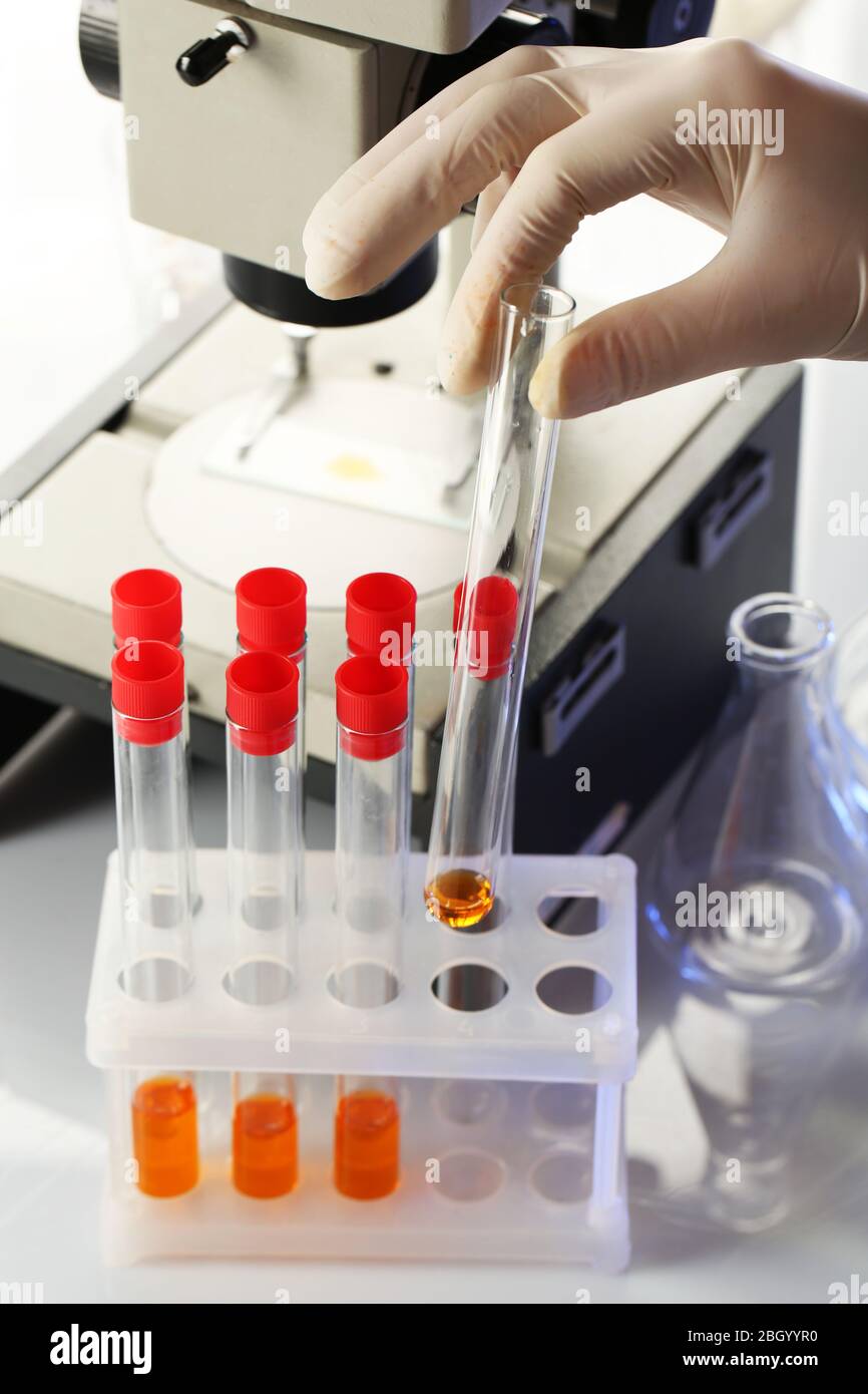 Assistant hand in gloves making analysis in laboratory with microscope ...