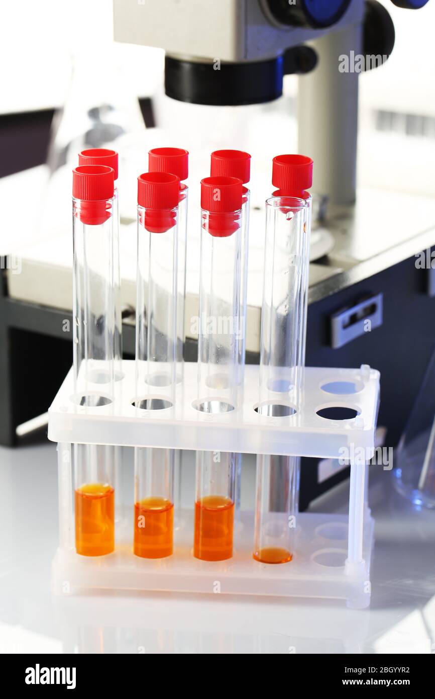 Test tubes with liquid and microscope in laboratory on white table ...