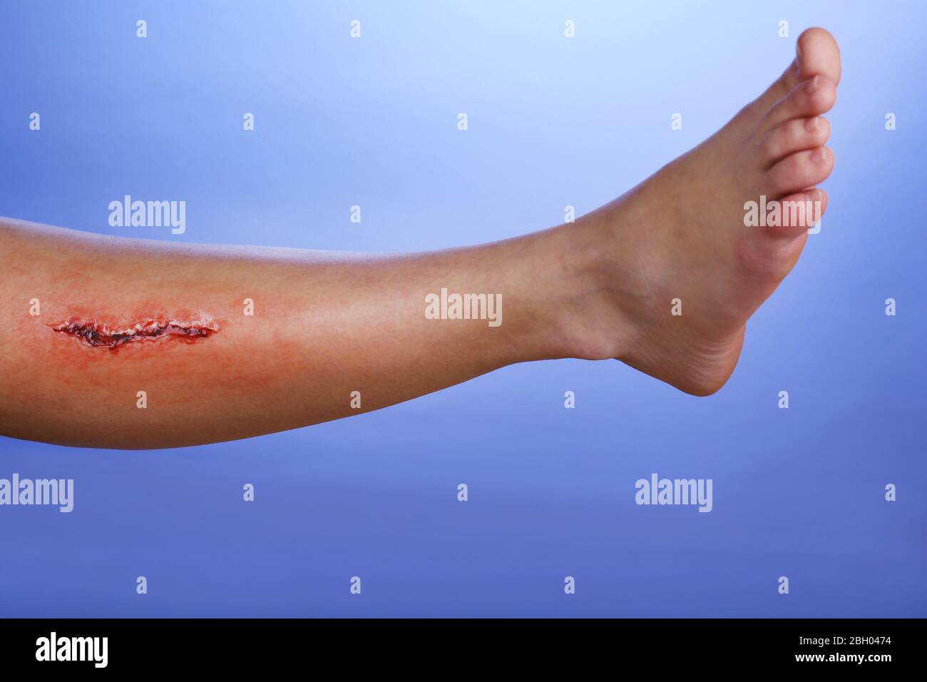 Injured leg with blood on blue background Stock Photo - Alamy