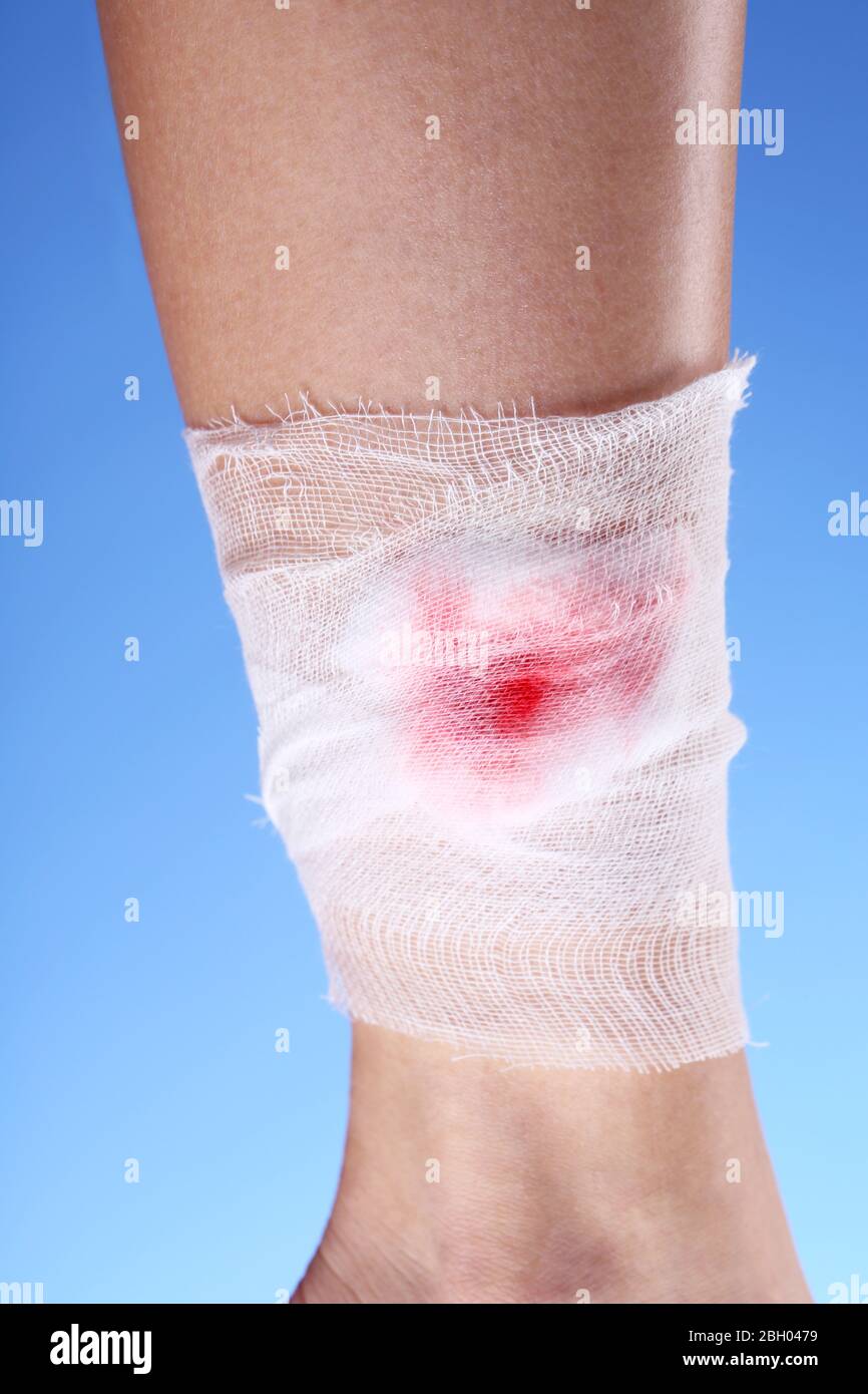 Wounded leg with bandage on blue background Stock Photo - Alamy