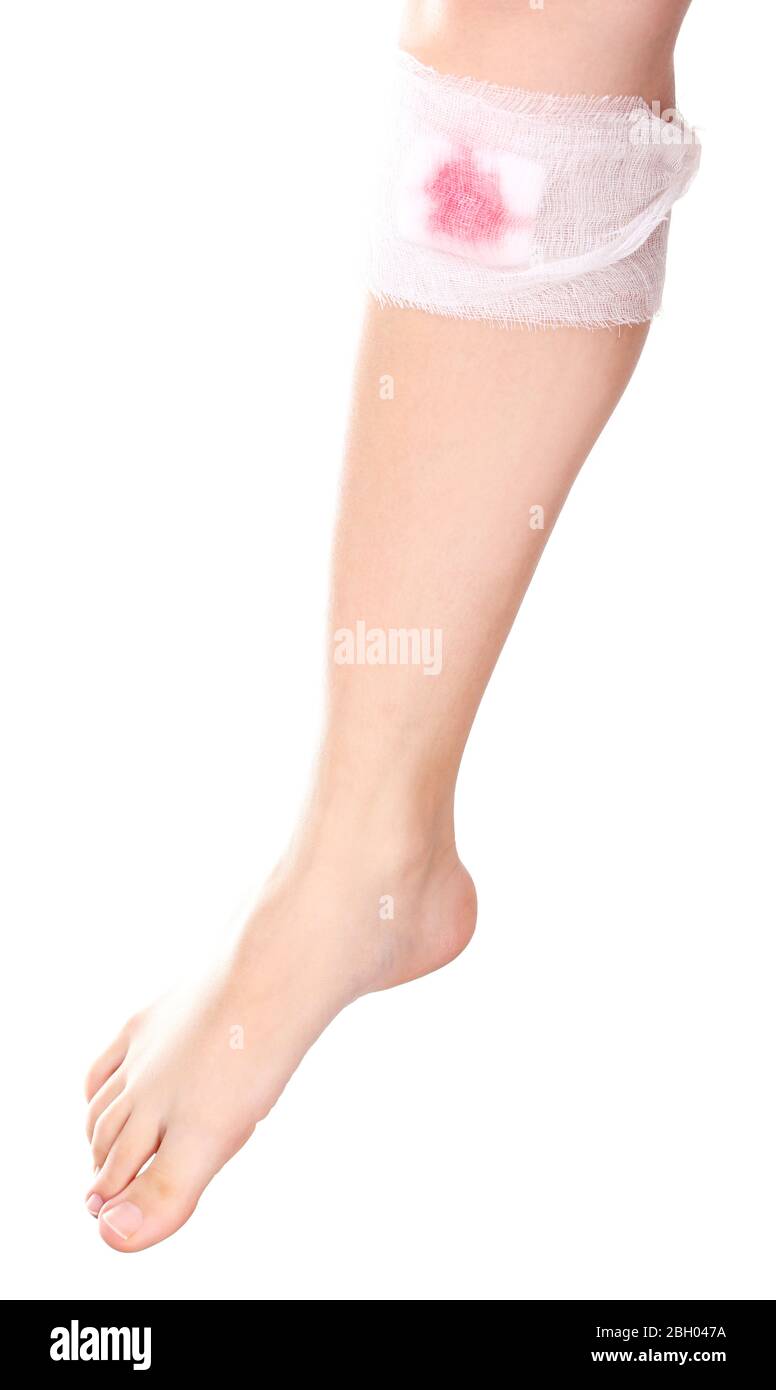 Wounded leg with bandage isolated on white Stock Photo - Alamy