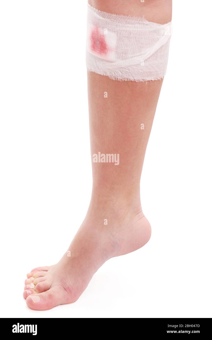 Wound infection operation hi-res stock photography and images - Alamy