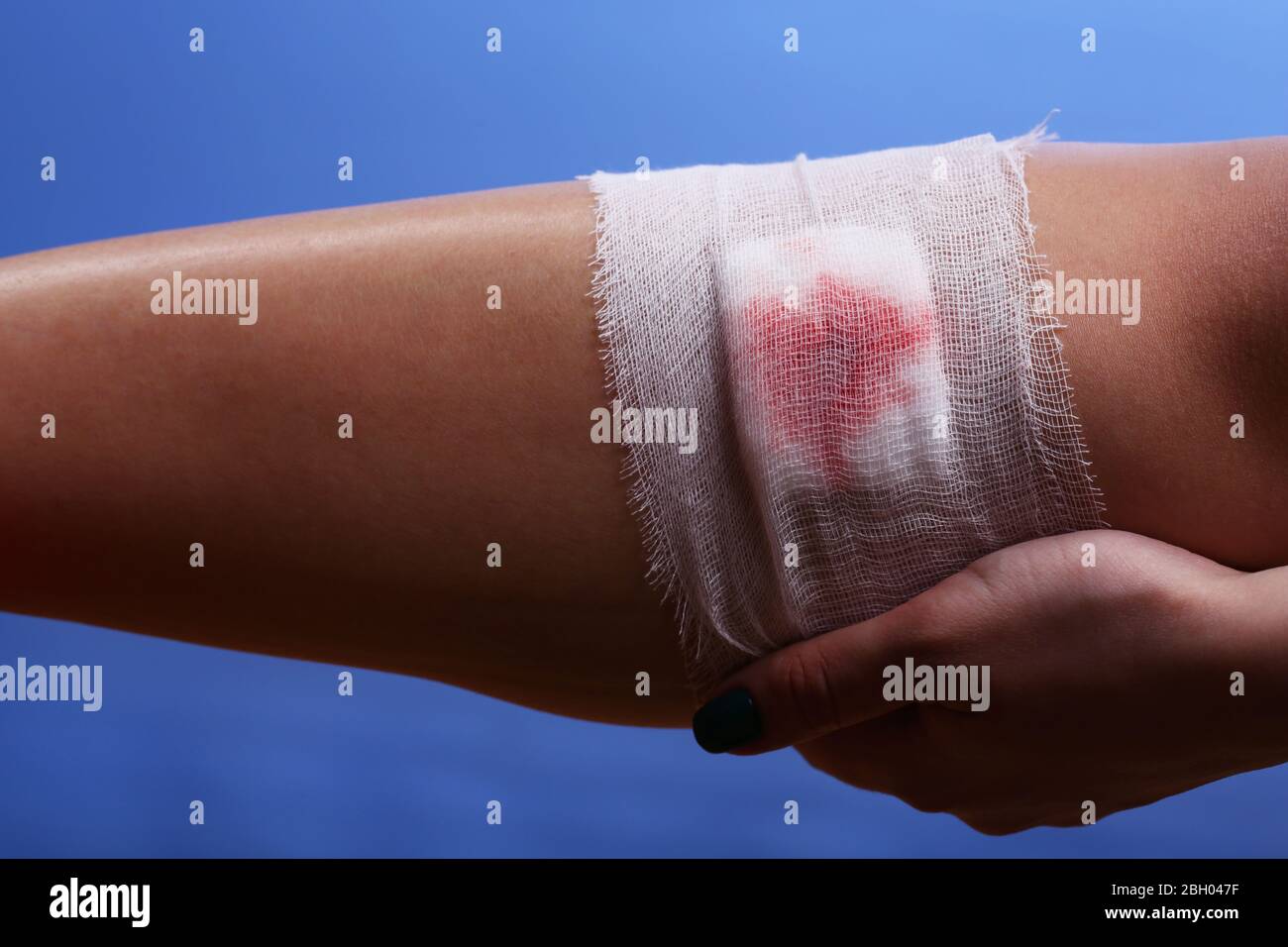 Wound Infection Operation High Resolution Stock Photography and Images ...