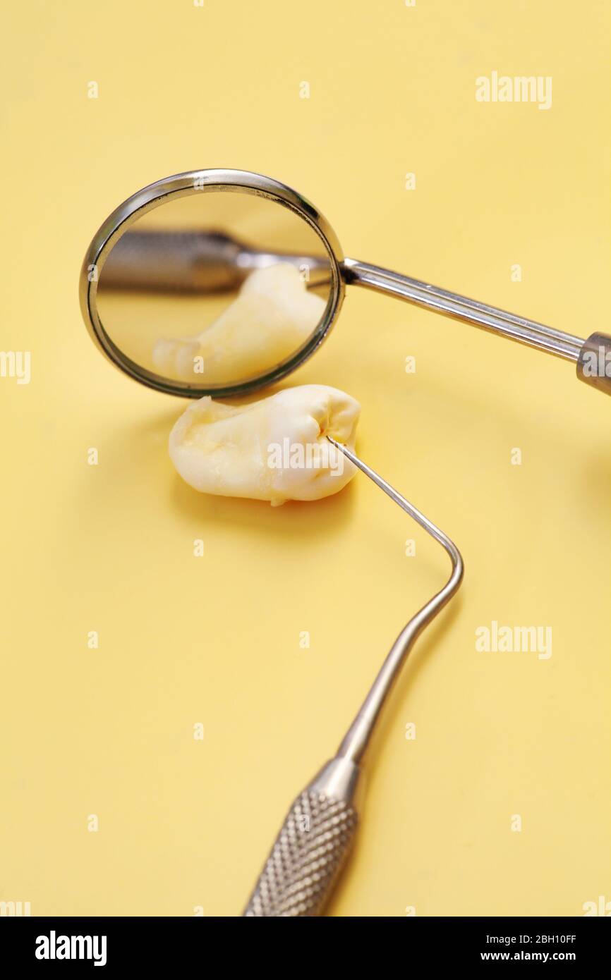 Real Human Wisdom tooth and Dental Mirror. Removing wisdom teeth Stock ...