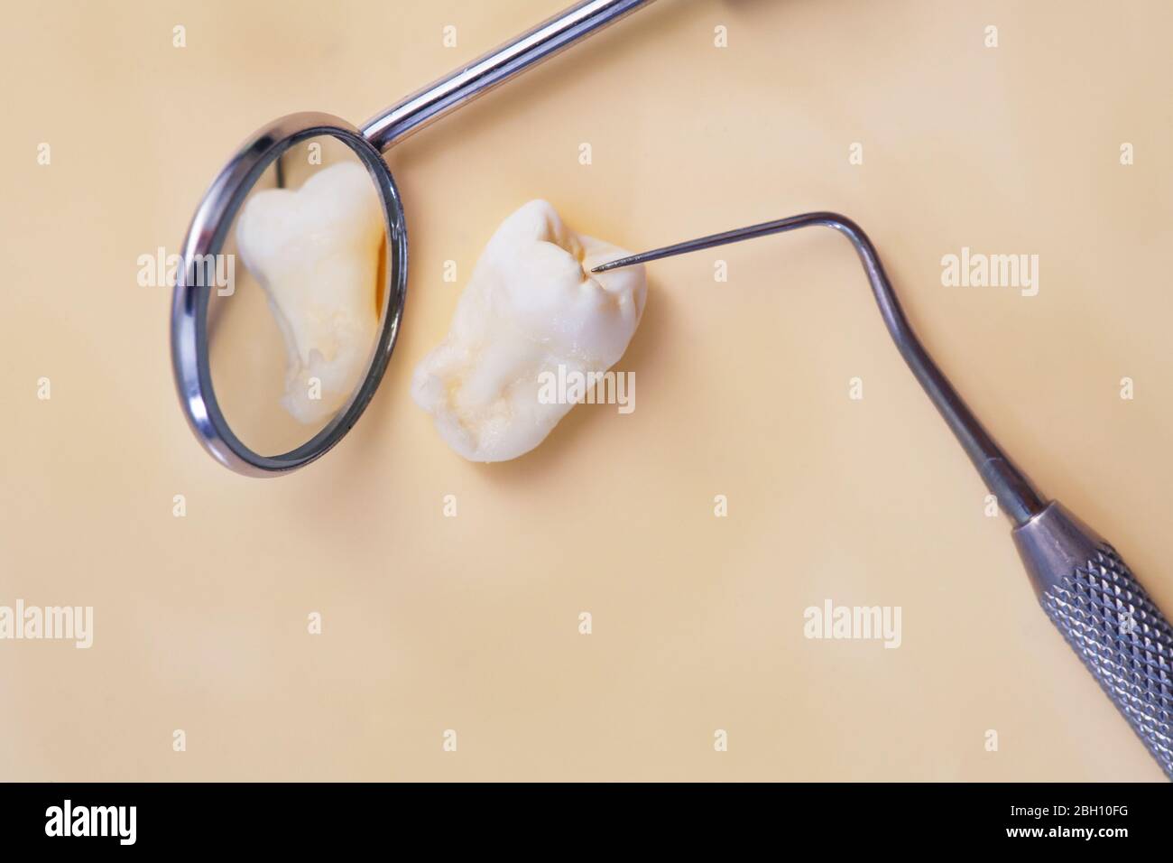 Real Human Wisdom tooth and Dental Mirror. Removing wisdom teeth Stock ...