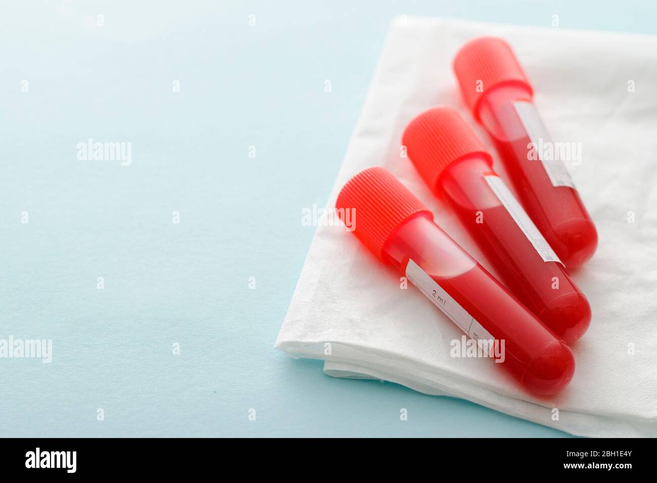 Three test tubes with blood samples on a folded white tissue or cloth ...