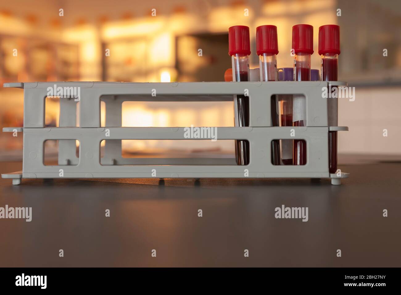 Blood tubes in a rack on table in intensive care unit in hospital. The ...