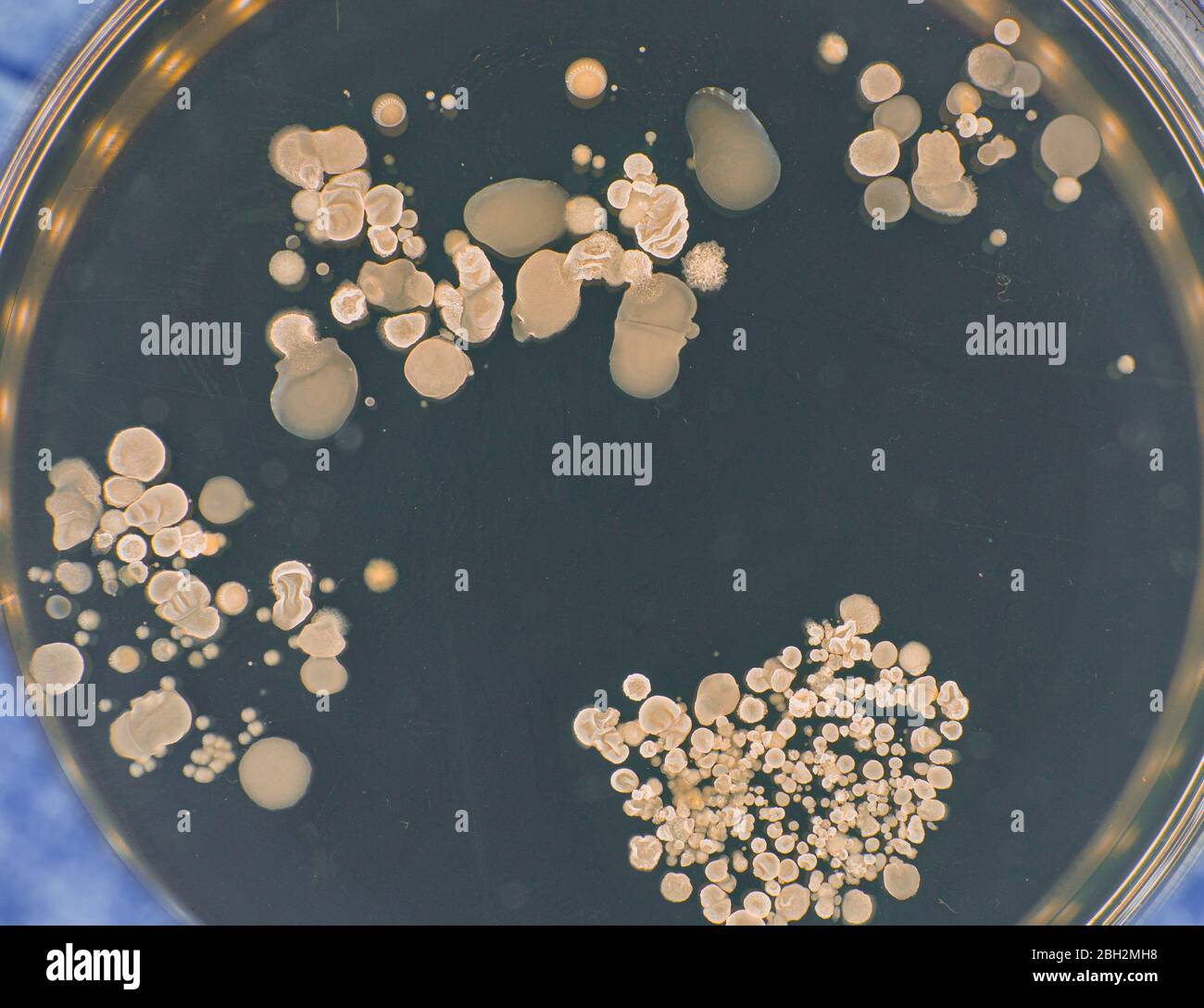 Trichophyton hi-res stock photography and images - Alamy