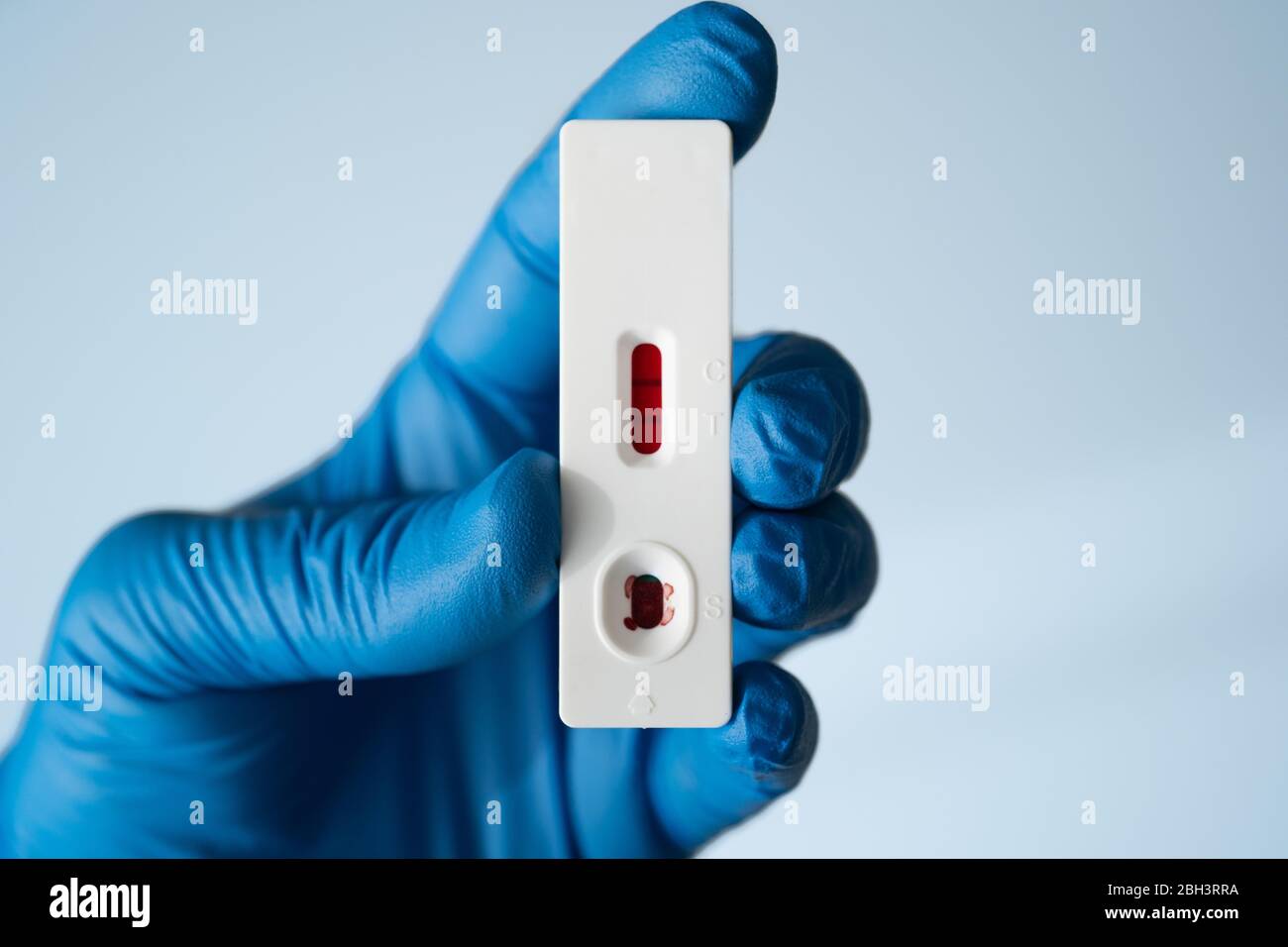 Doctor holding a test kit for viral disease COVID-19 2019-nCoV. Lab ...