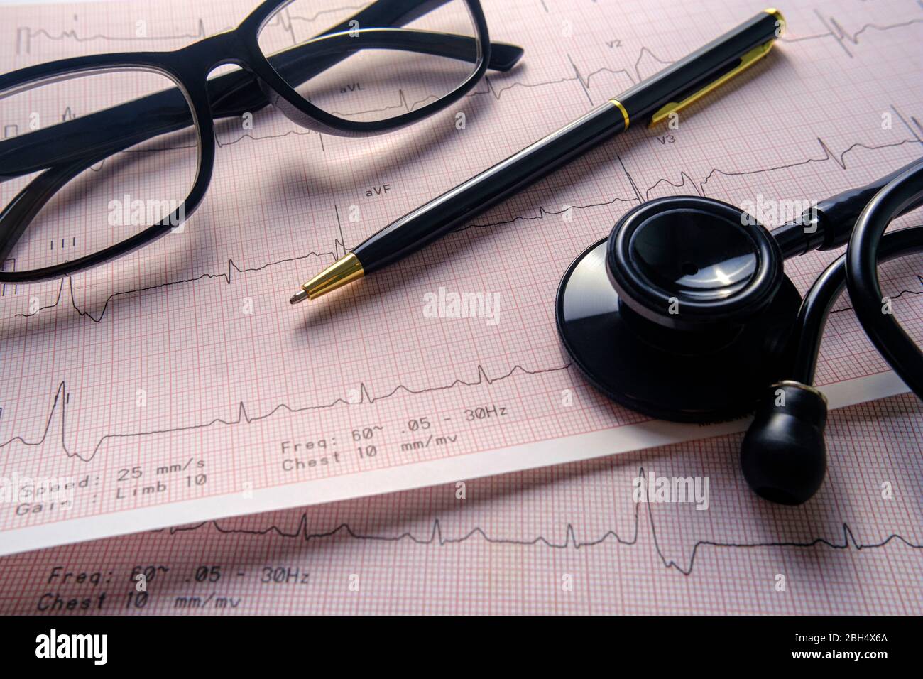 Stethoscope, glasses and pen on electrocardiogram Stock Photo - Alamy