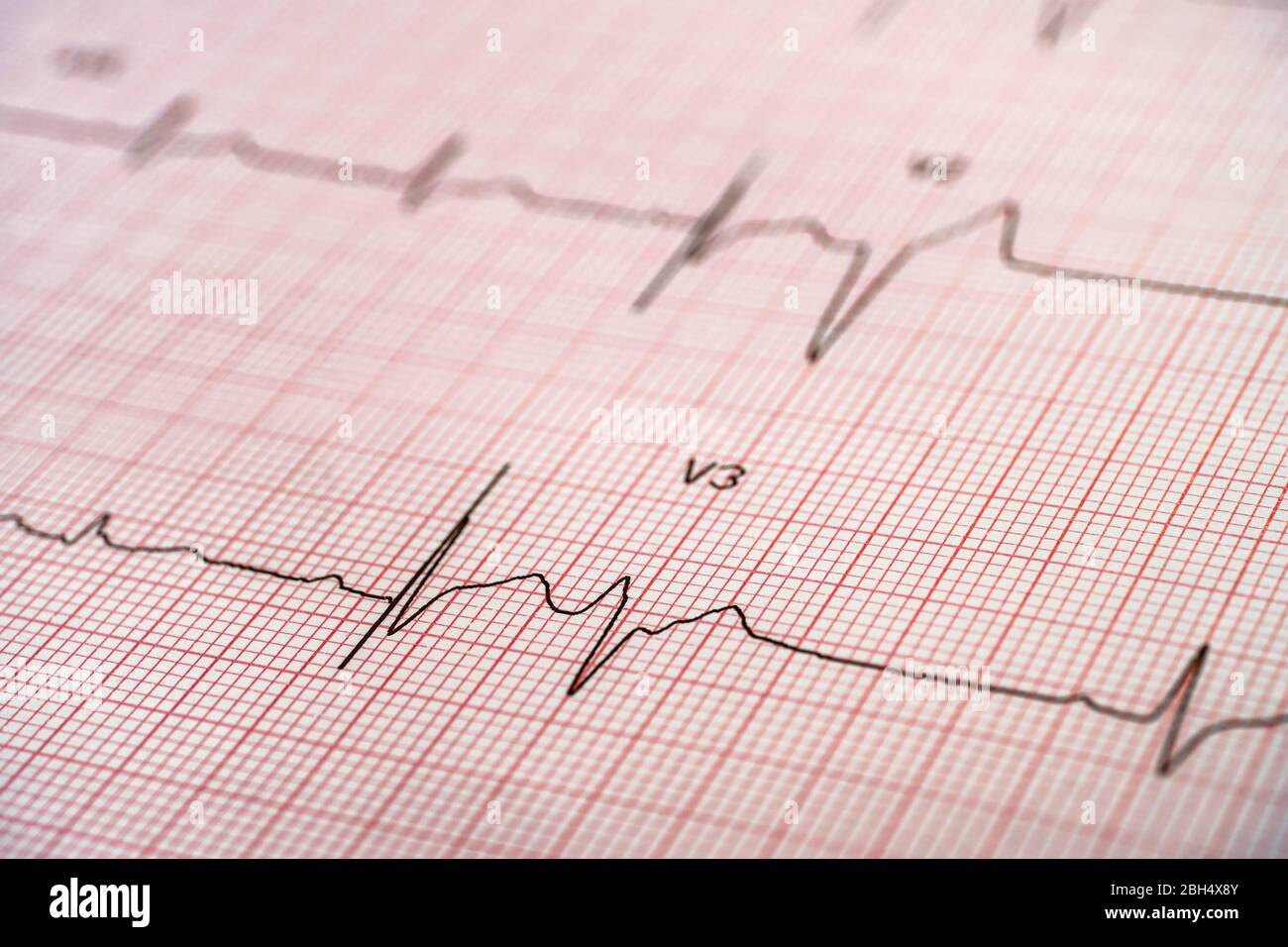 Electrocardiogram on red graph paper Stock Photo - Alamy