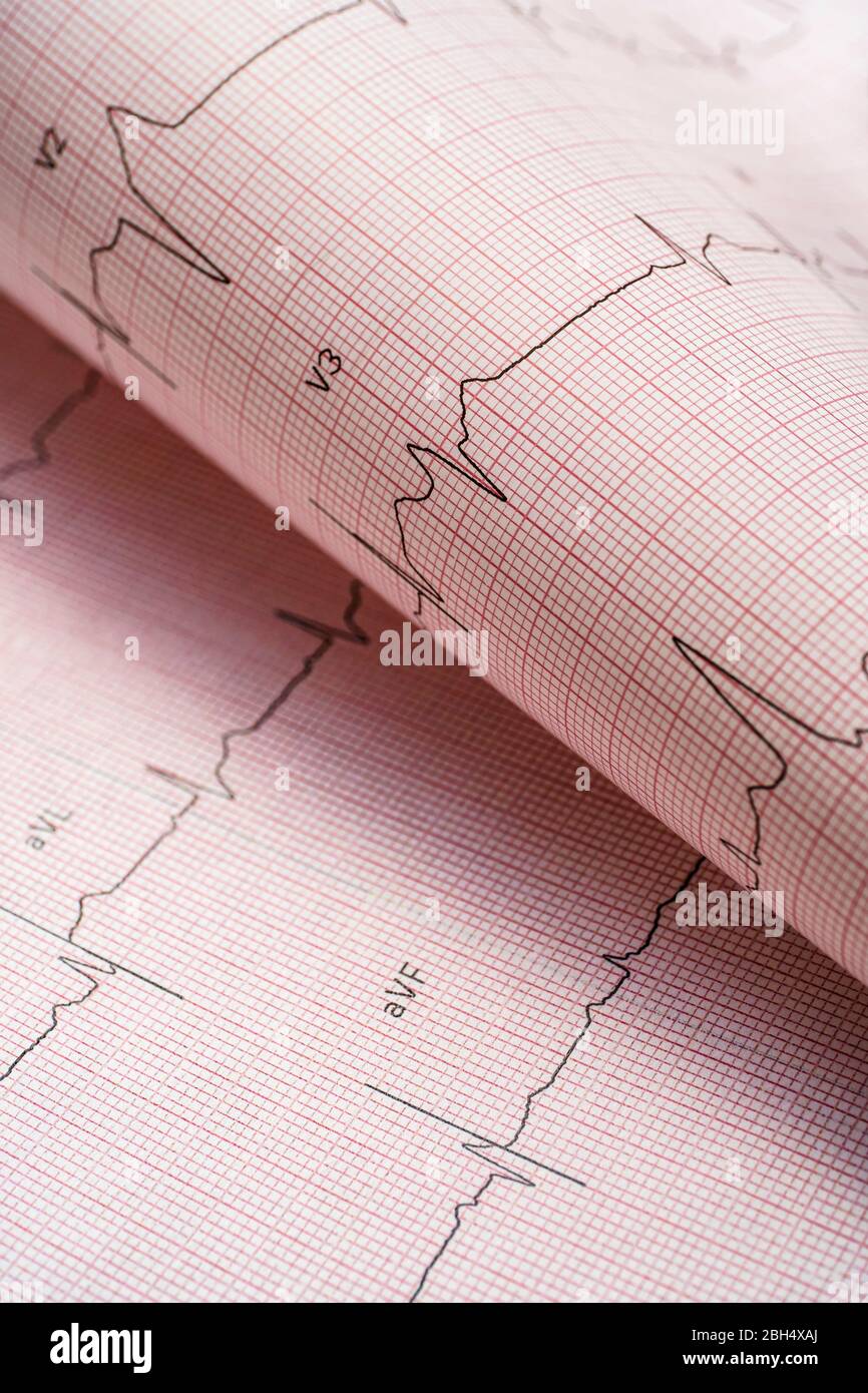 Electrocardiogram on red graph paper Stock Photo - Alamy
