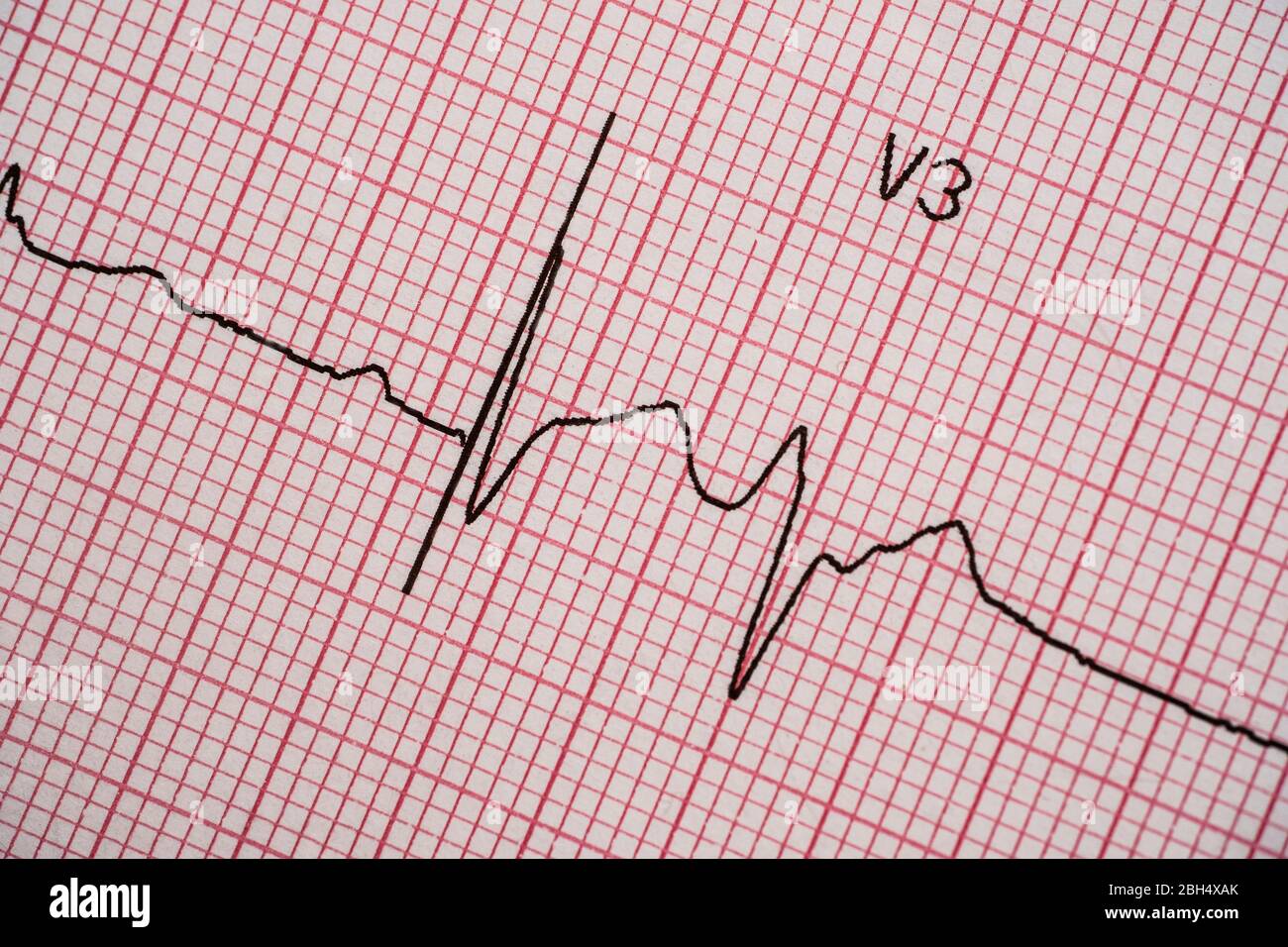 Electrocardiogram ekg hi-res stock photography and images - Alamy